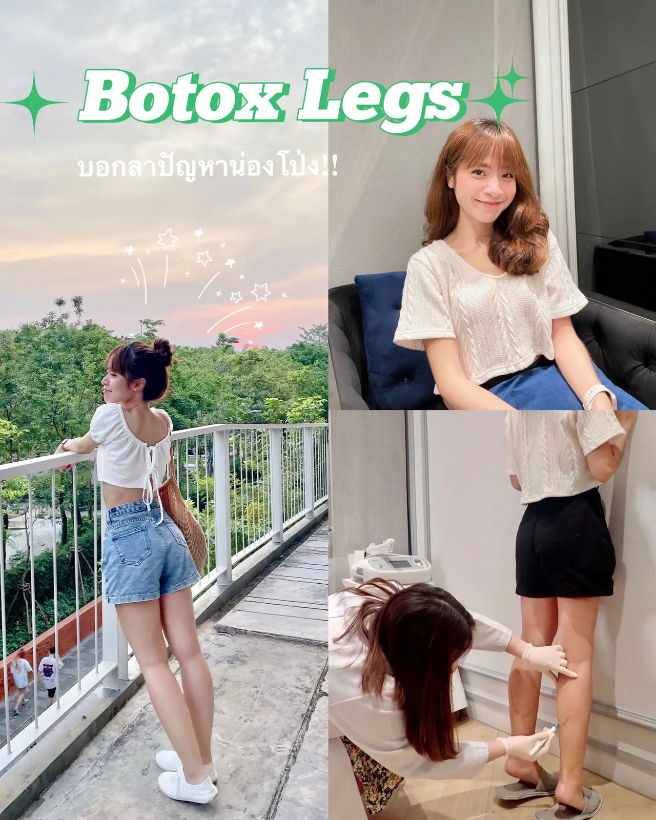 Review พลีชีพ ครั้งแรกของชีวิตกับการฉีด botox น่อง🌷 | แกลเลอรีที่โพสต์โดย Gatjangg | Lemon8