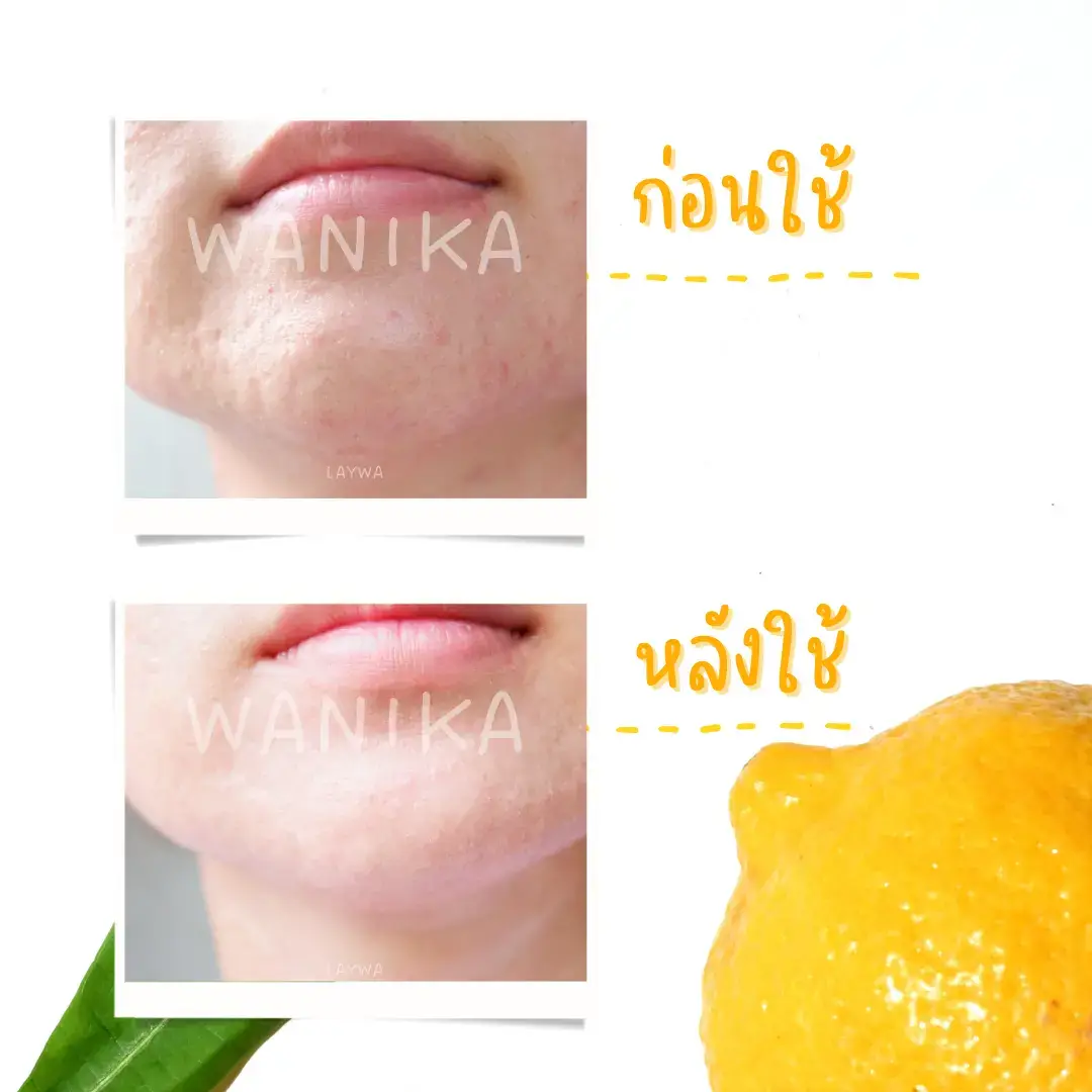 รีวิว วานิก้าเซรั่มวิตามินซี WANIKA บูสต์ผิวใส คุมมัน เคลียร์รอยดํา | แกลเลอรีที่โพสต์โดย Laywa ...