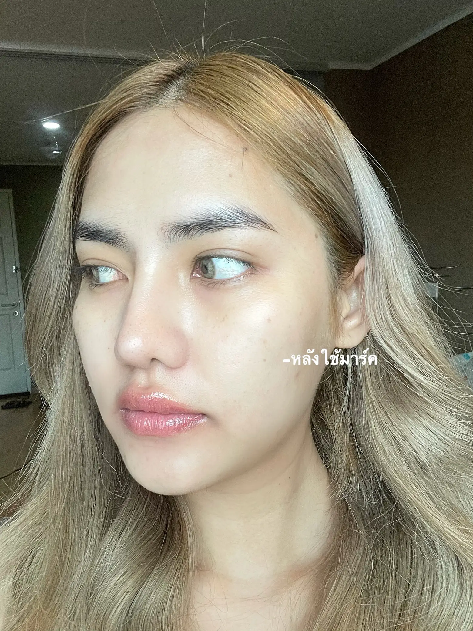 เคล็ดลับหน้าใส ที่ไม่ลับอีกต่อไป🙈 | แกลเลอรีที่โพสต์โดย Cherpat_ | Lemon8