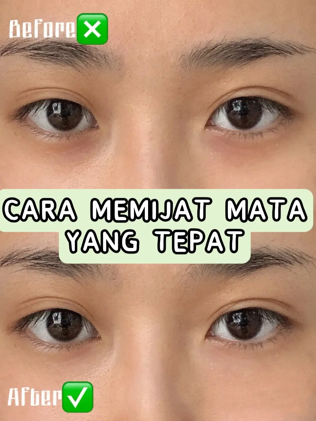 👁️ CARA PIJAT MATA YANG BENAR | Galeri diposting oleh Fanny25 | Lemon8