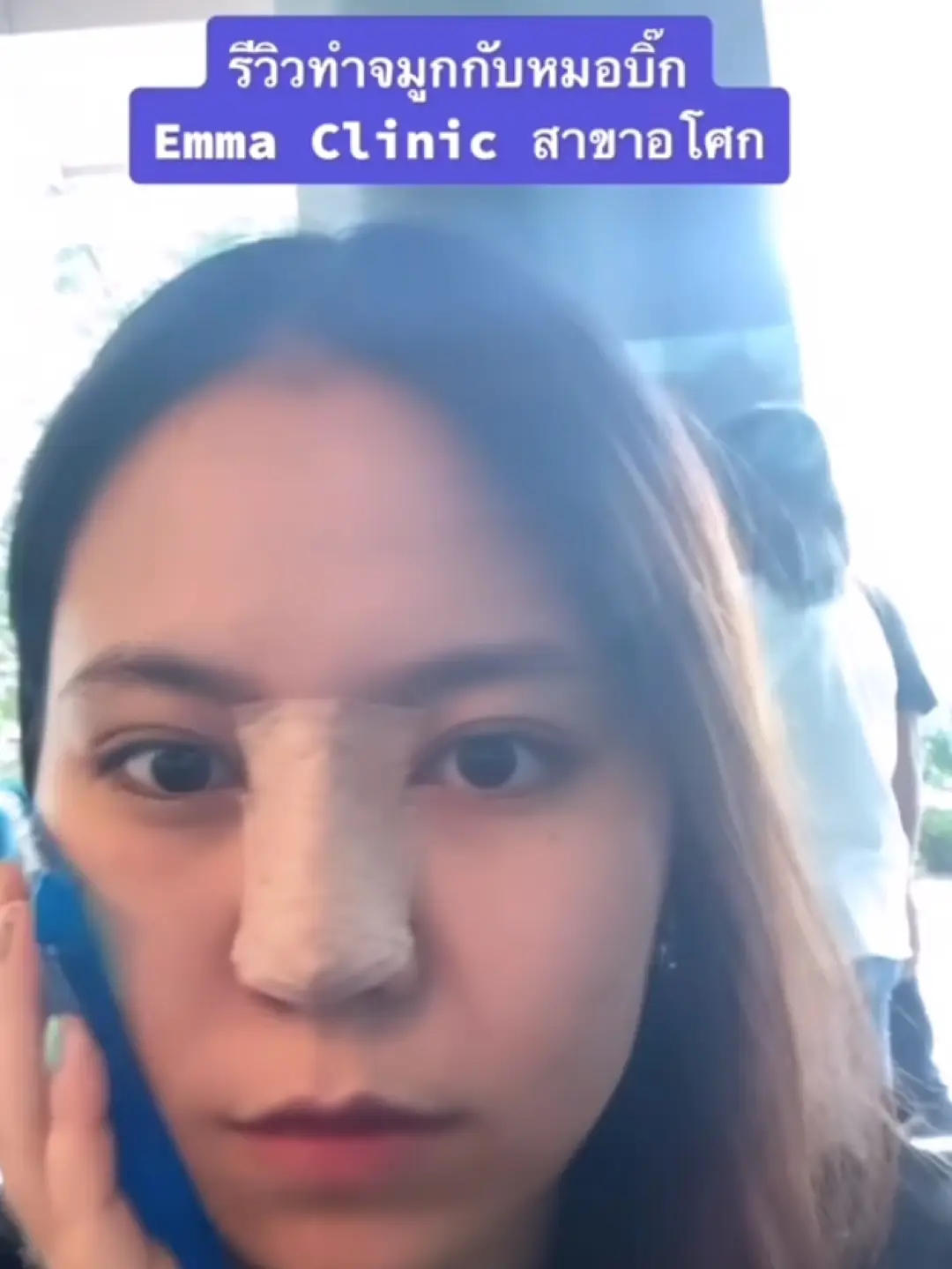 รีวิวทำจมูกครั้งแรกในชีวิตที่ Emma Clinic | วิดีโอที่เผยแพร่โดย Namssn ...