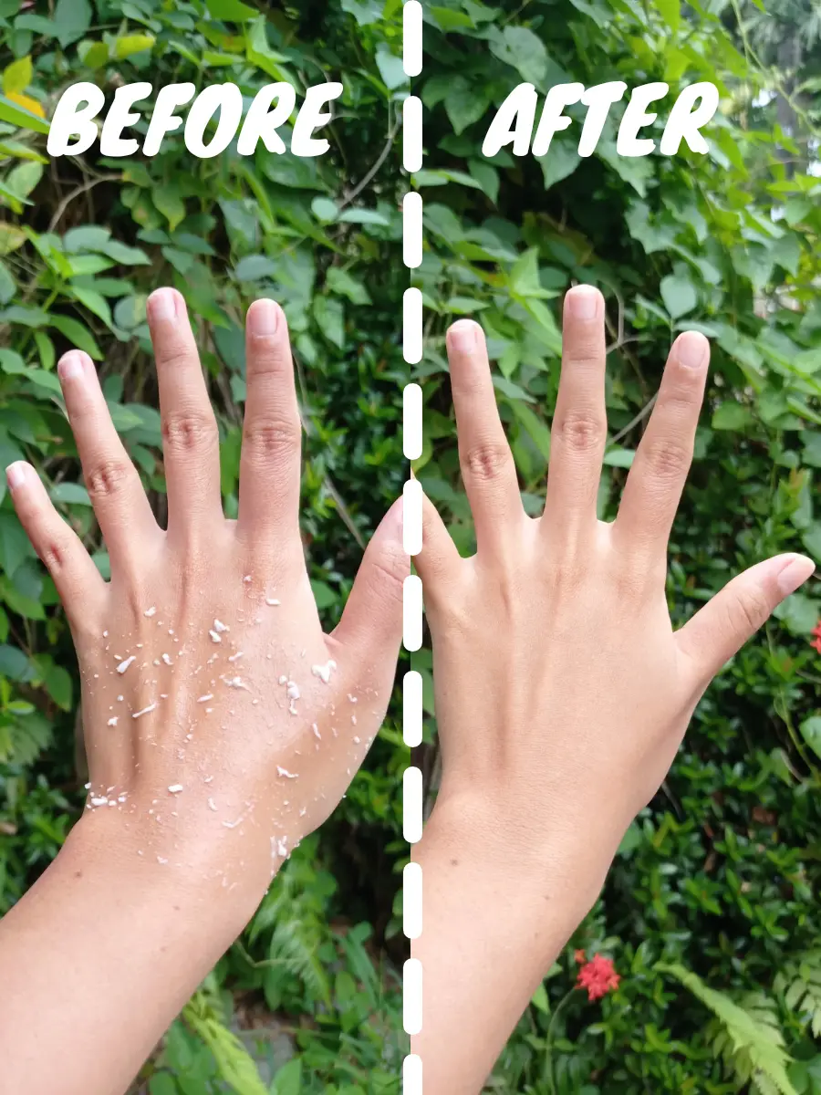 Exfoliasi Pakai Peeling Gel 🥰 | Galeri diposting oleh mymemine_i | Lemon8
