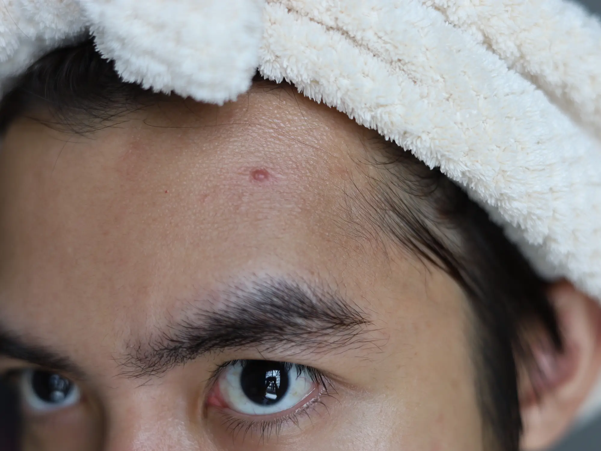 Medicsci Organic Dragon’s Blood Scar Gel Cream | แกลเลอรีที่โพสต์โดย ...