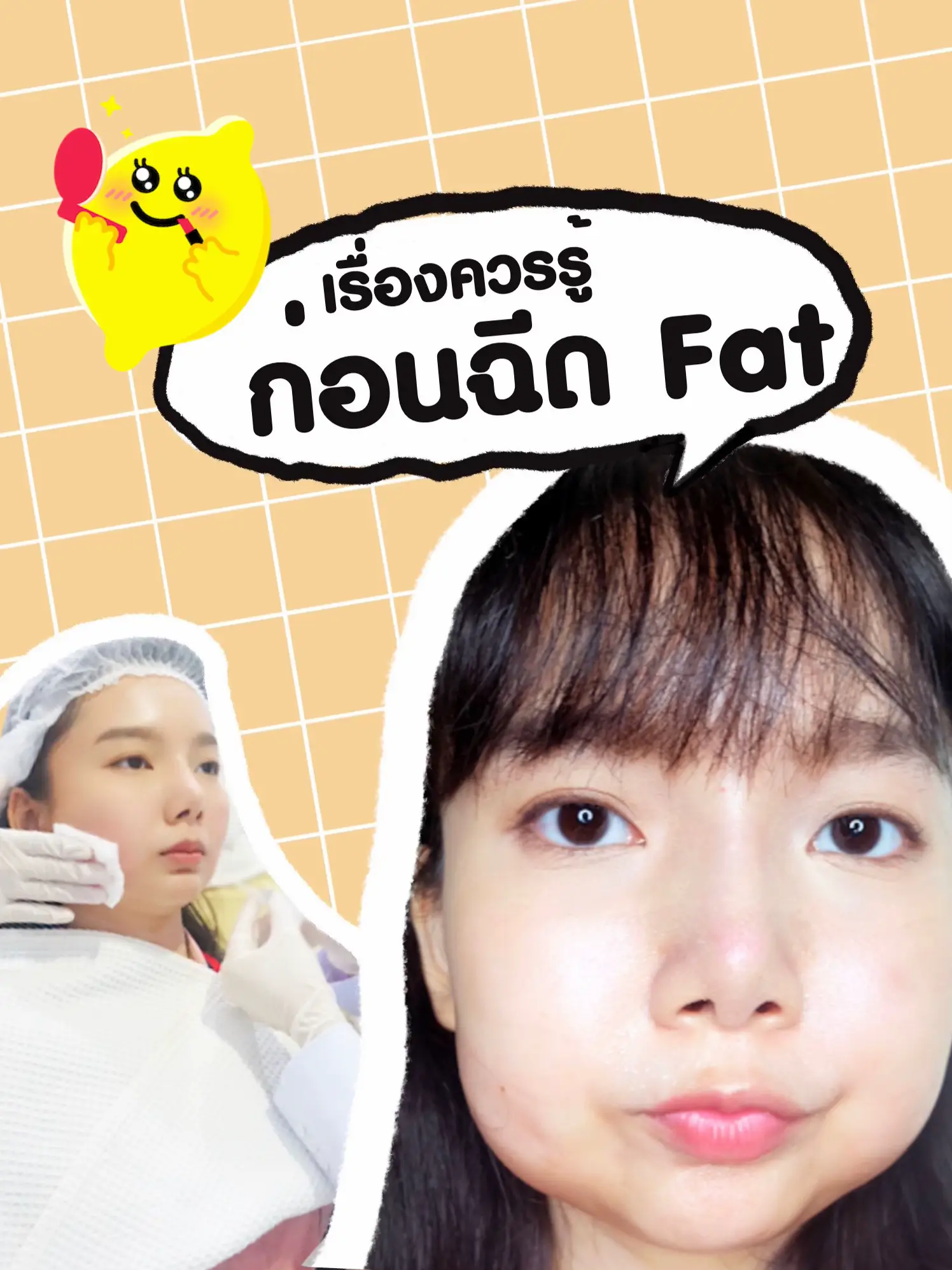 เตือน! เรื่องที่ทุกคนควรรู้ก่อนตัดสินใจฉีด Meso FAT | แกลเลอรีที่โพสต์โดย ployturtle | Lemon8