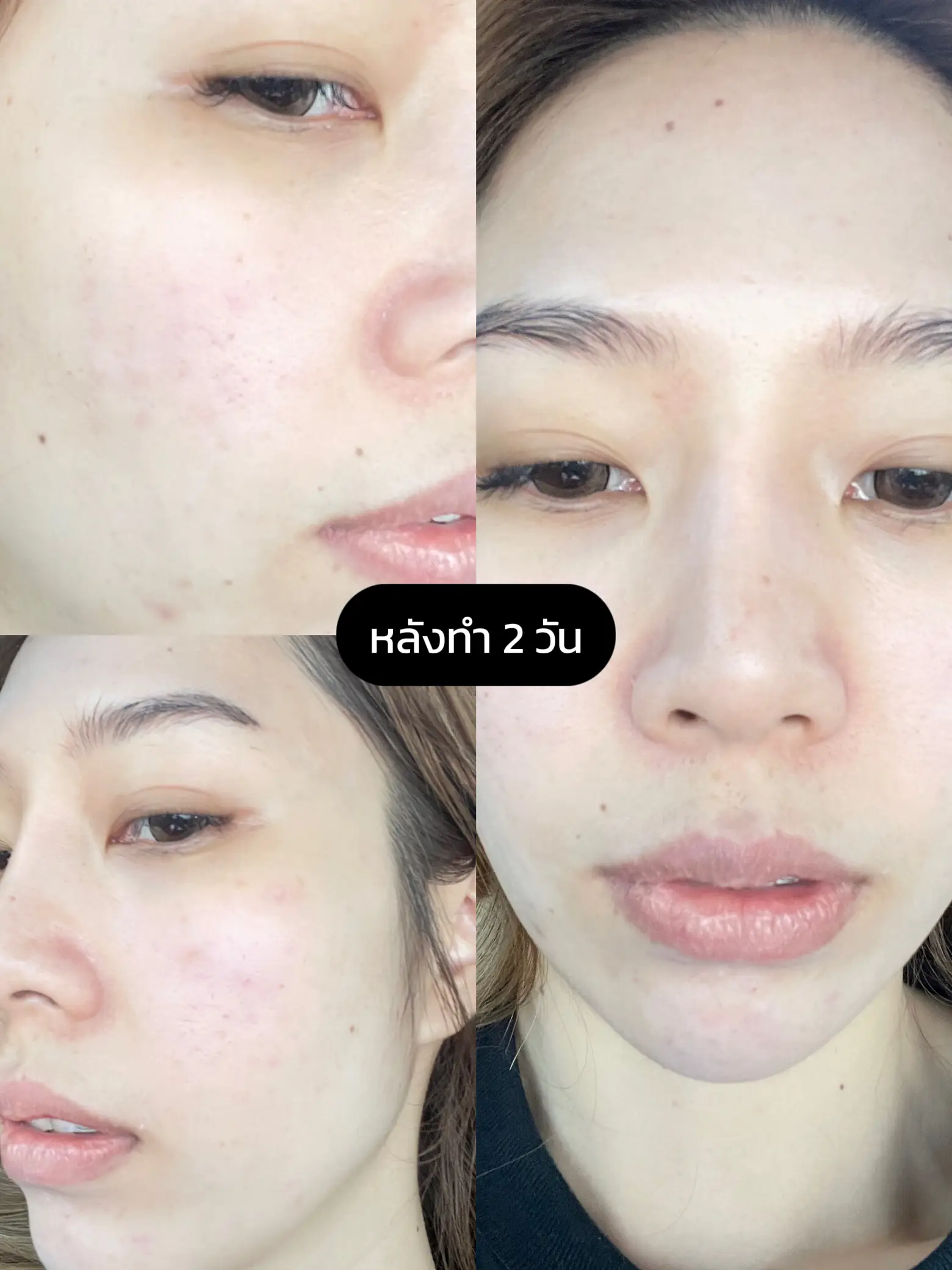 20 ไอเดียยอดนิยมเกี่ยวกับ Reju Skin รีวิว ในปี 2024