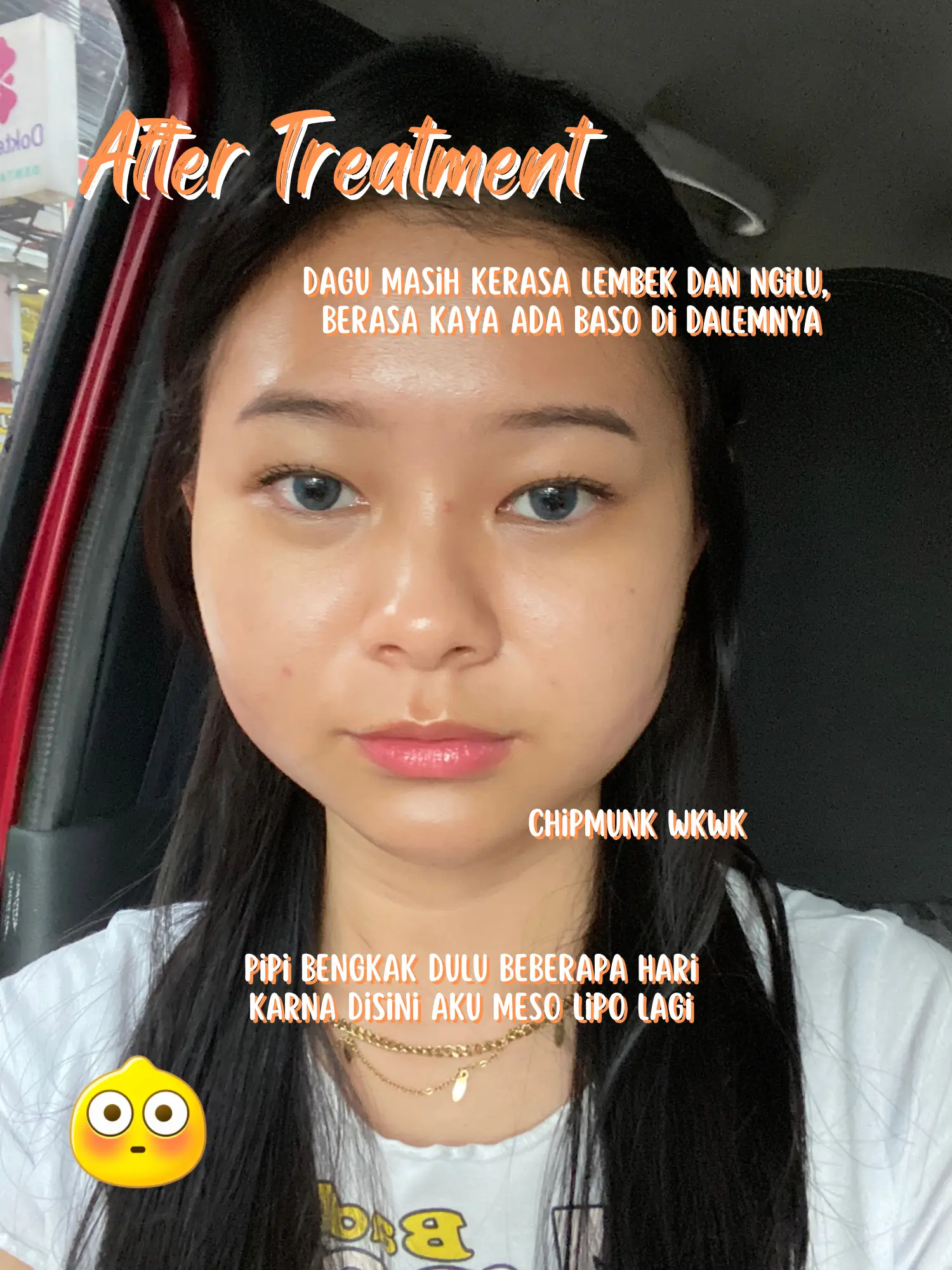 MAU PUNYA WAJAH TIRUS?? BISA COBA TREATMENT INI!! | Galeri diposting ...