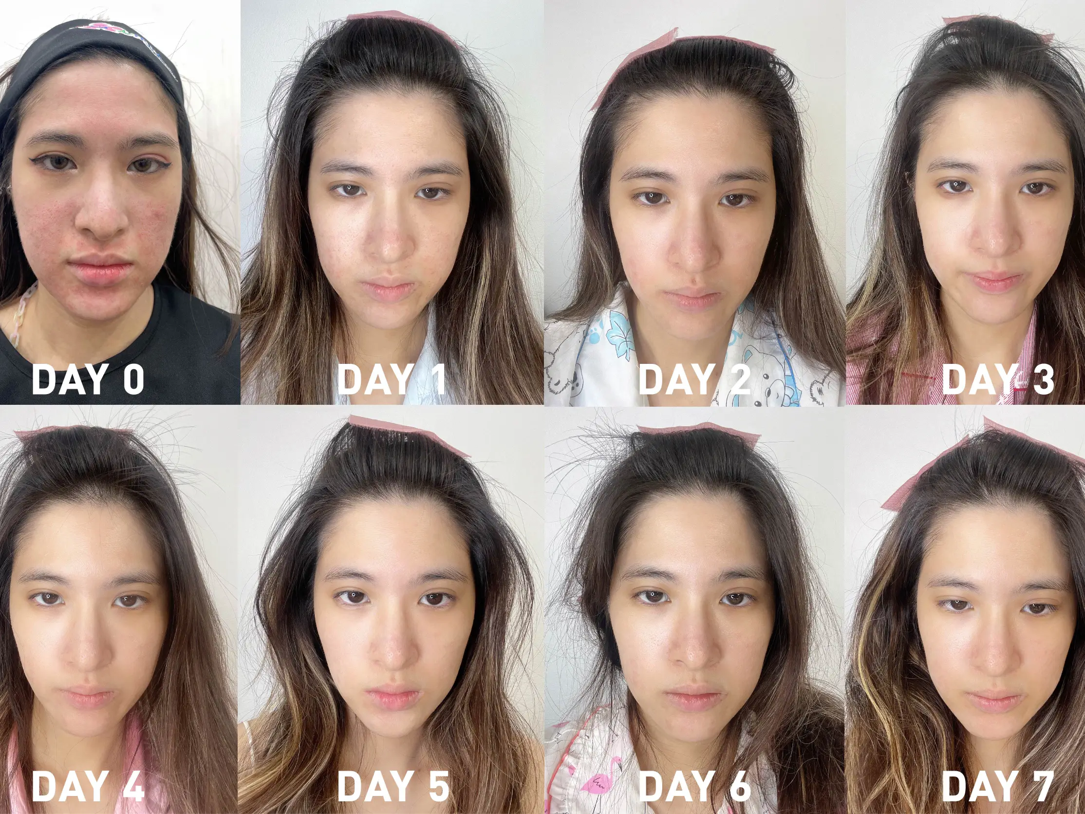 ทำ PICO ครั้งแรก!! จะรอดมั้ย? | แกลเลอรีที่โพสต์โดย cinearism💀 | Lemon8