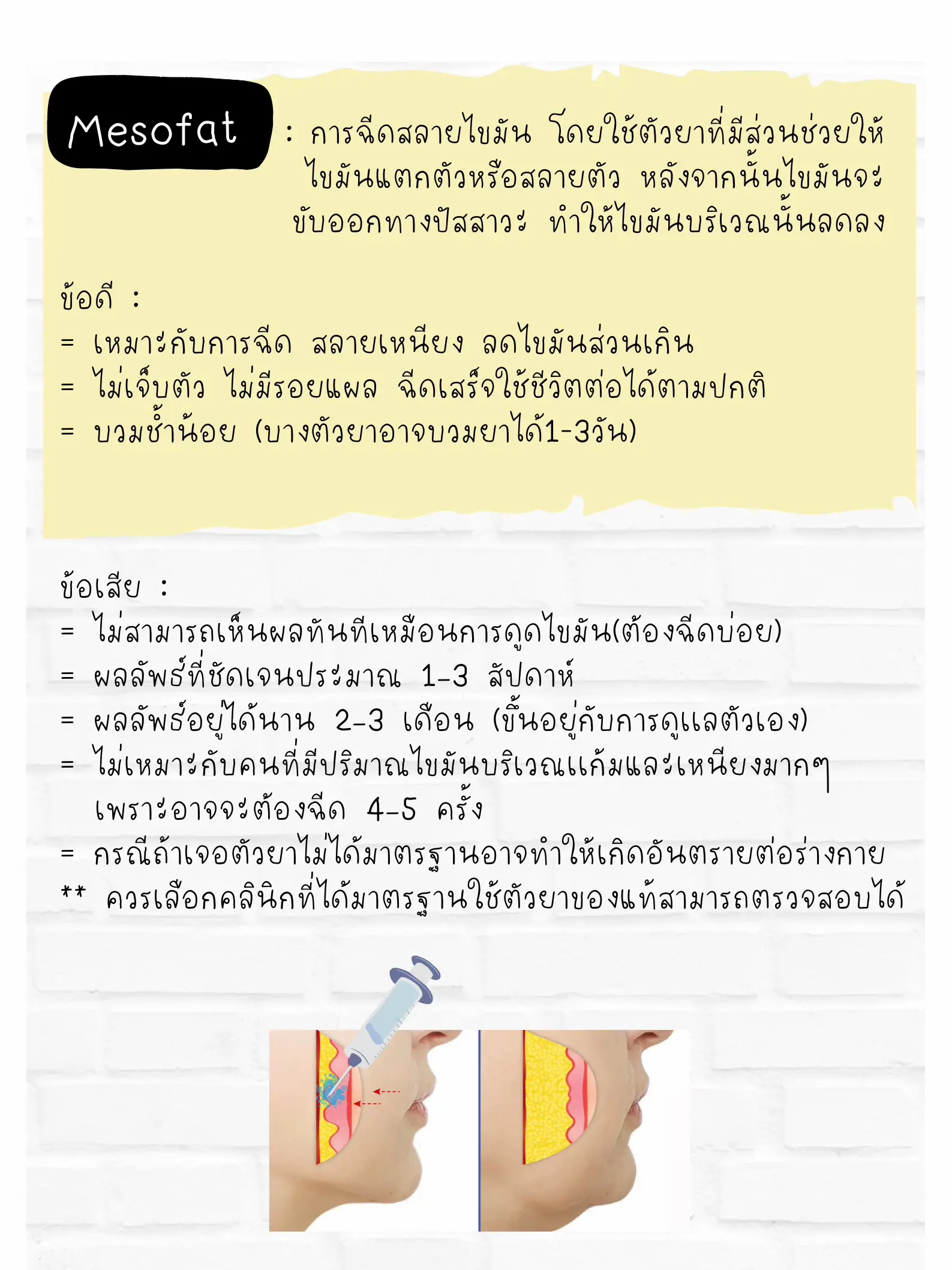 จิ้มแบบไหนดี? ถ้าอยากมีรูปหน้า “วีเชฟ” | แกลเลอรีที่โพสต์โดย Yuinsoul.bt | Lemon8