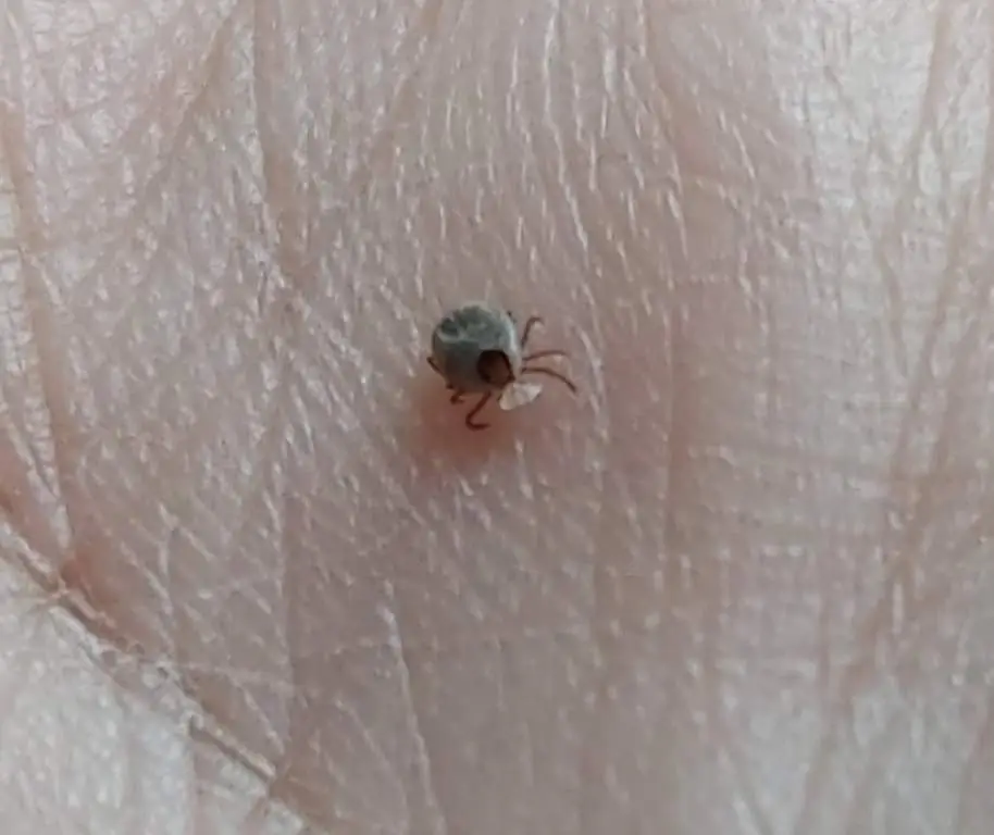 หมัดกัด - การค้นหาใน Lemon8