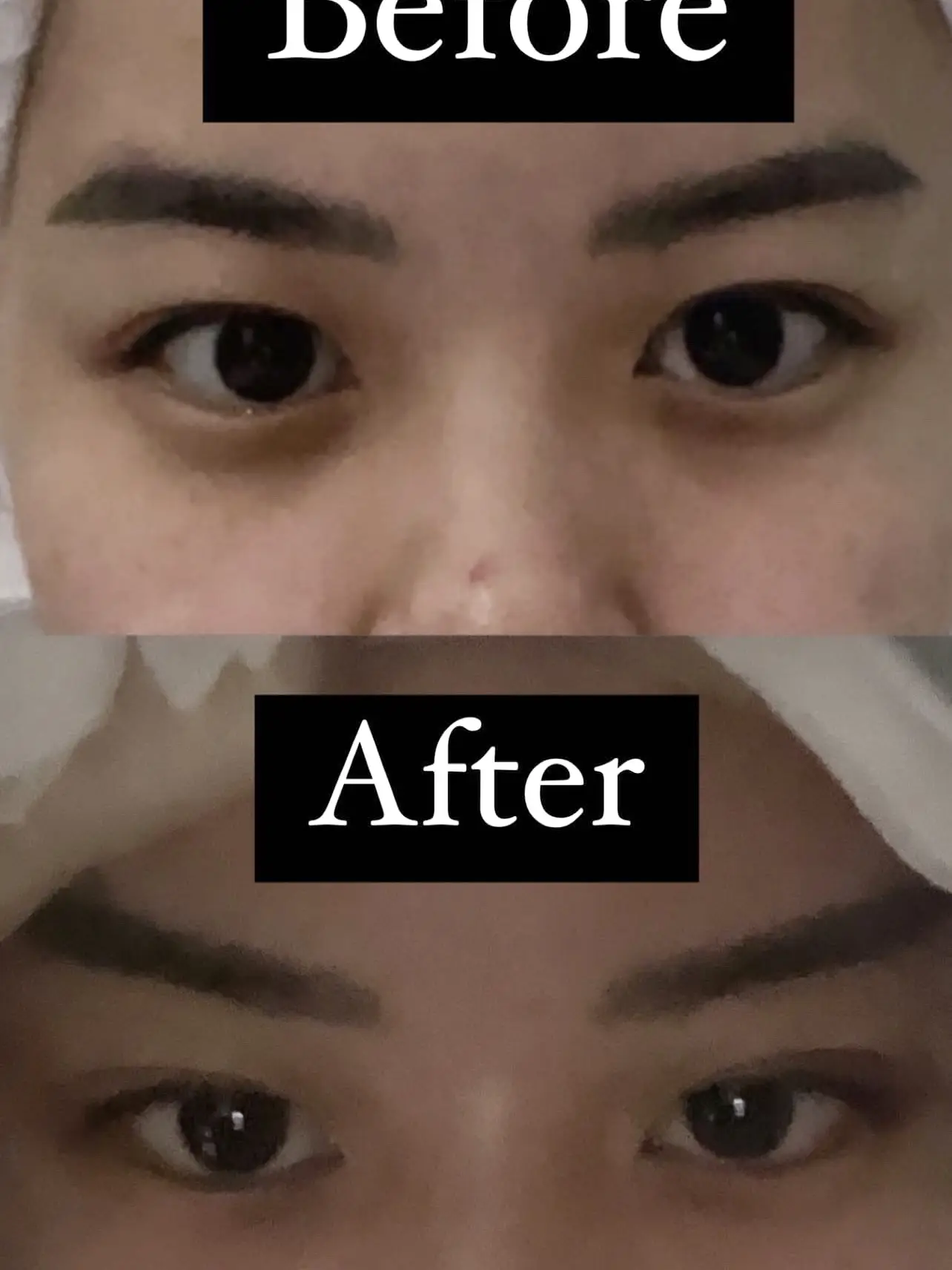 ทำ Foxy eyes แบบศัลยกรรม!👀 ปรับลุคตาเฉี่ยวคมมากขึ้น🫶🏻 | แกลเลอรีที่ ...