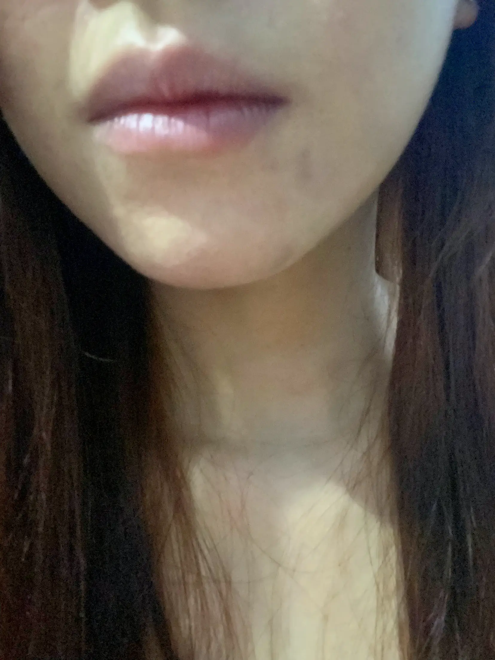 รีวิวแบบเรียลๆ ROJUKISS 5X hyaluron lip 🍑💄 | แกลเลอรีที่โพสต์โดย Ploy Sasipim | Lemon8