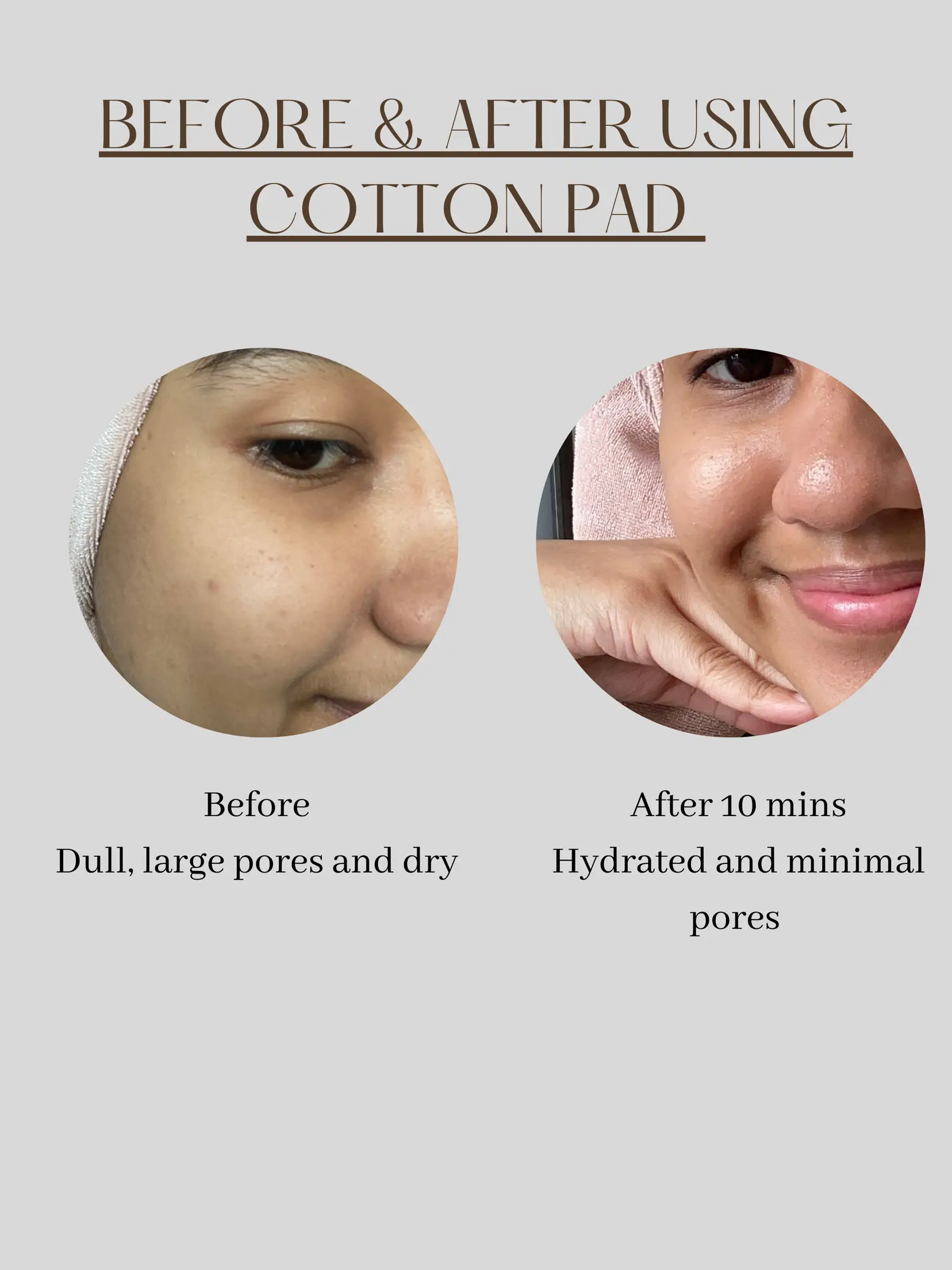 DIY Toner Pads | You only need 2 things! 😍 | Galeri disiarkan oleh ...