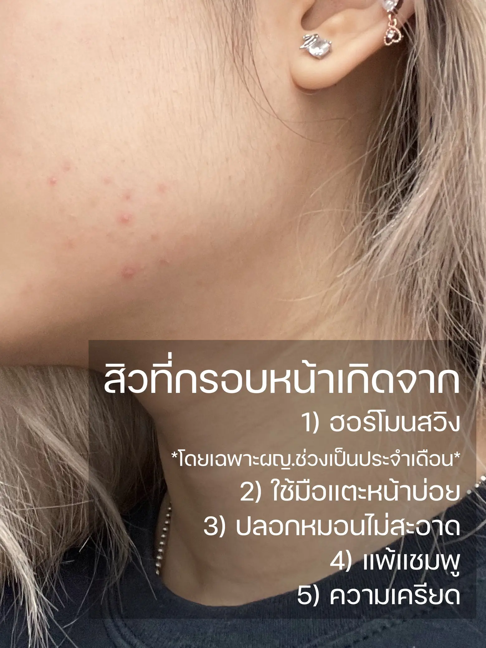ช่วยด้วย😭 ทำไมขึ้นกรอบหน้าแบบนี้📌 | แกลเลอรีที่โพสต์โดย Poly.Reen | Lemon8