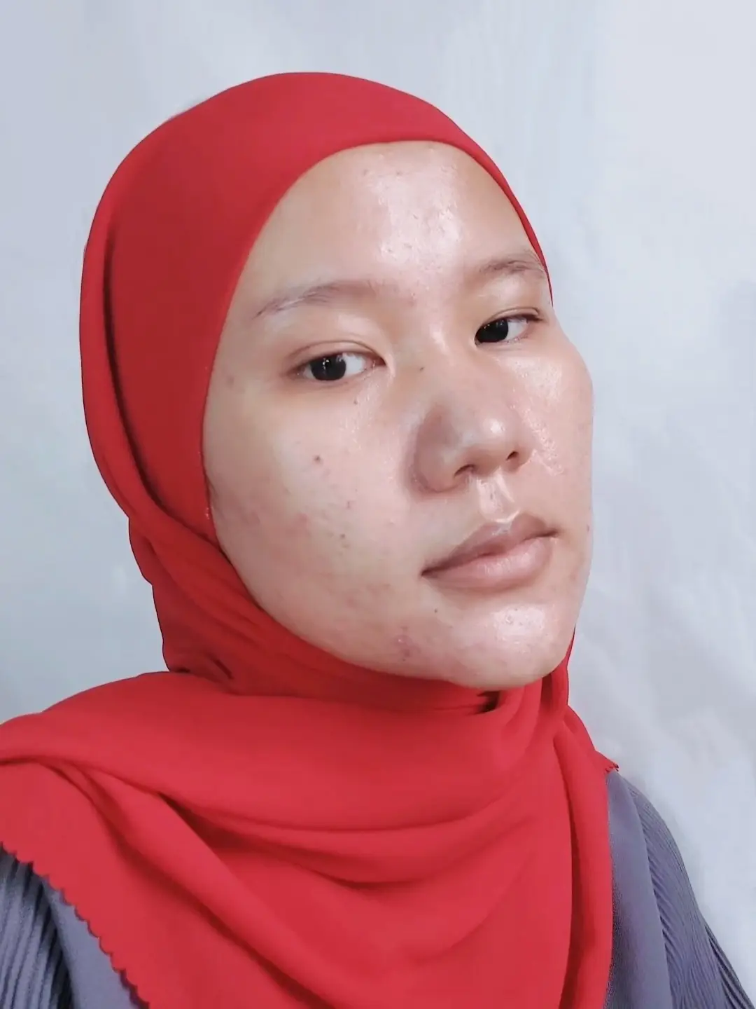 Skincare for acne prone skin | วิดีโอที่เผยแพร่โดย Dhilla | Lemon8