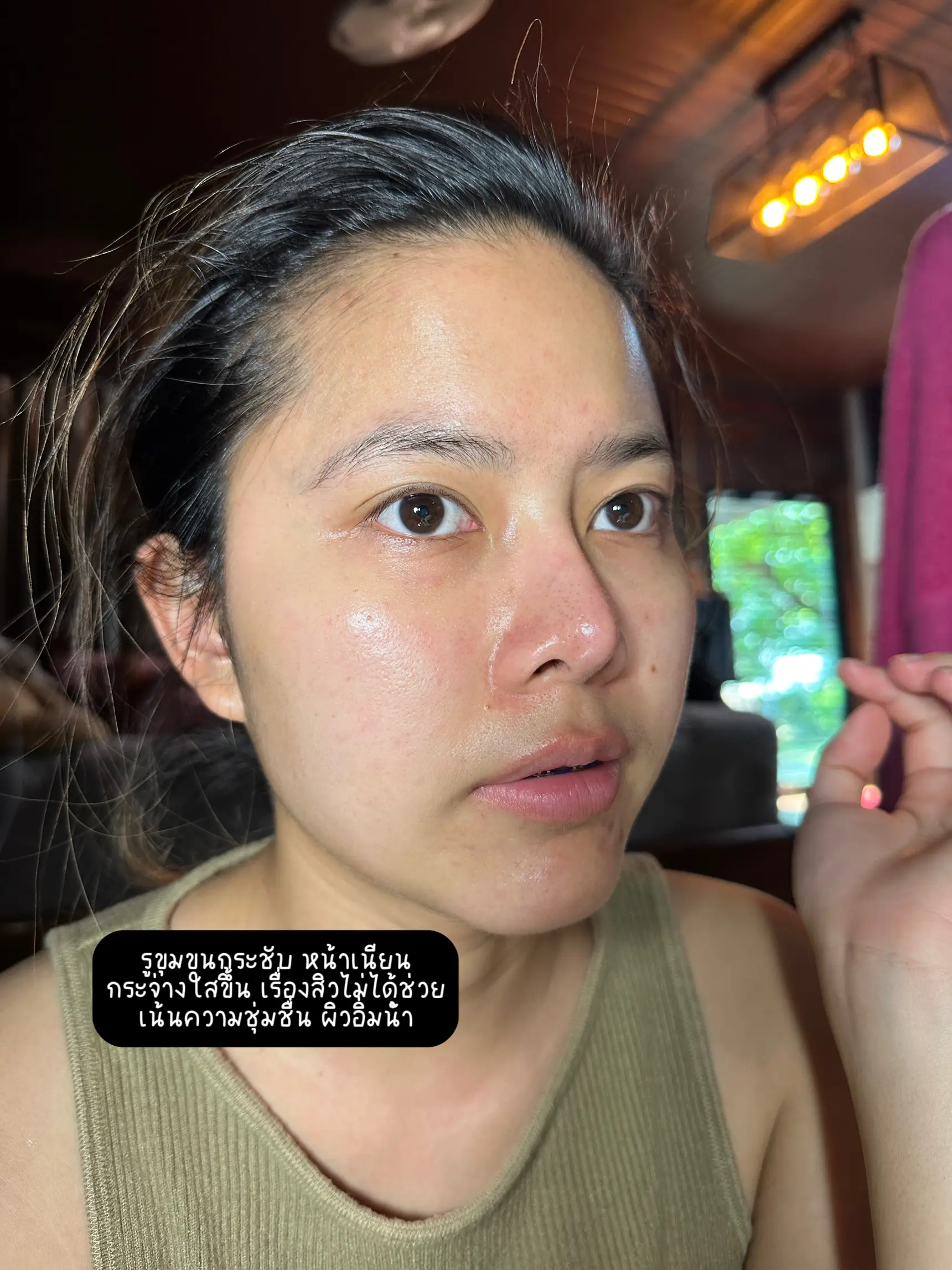 REJURAN ฉบับหน้าใส | แกลเลอรีที่โพสต์โดย ssompns | Lemon8