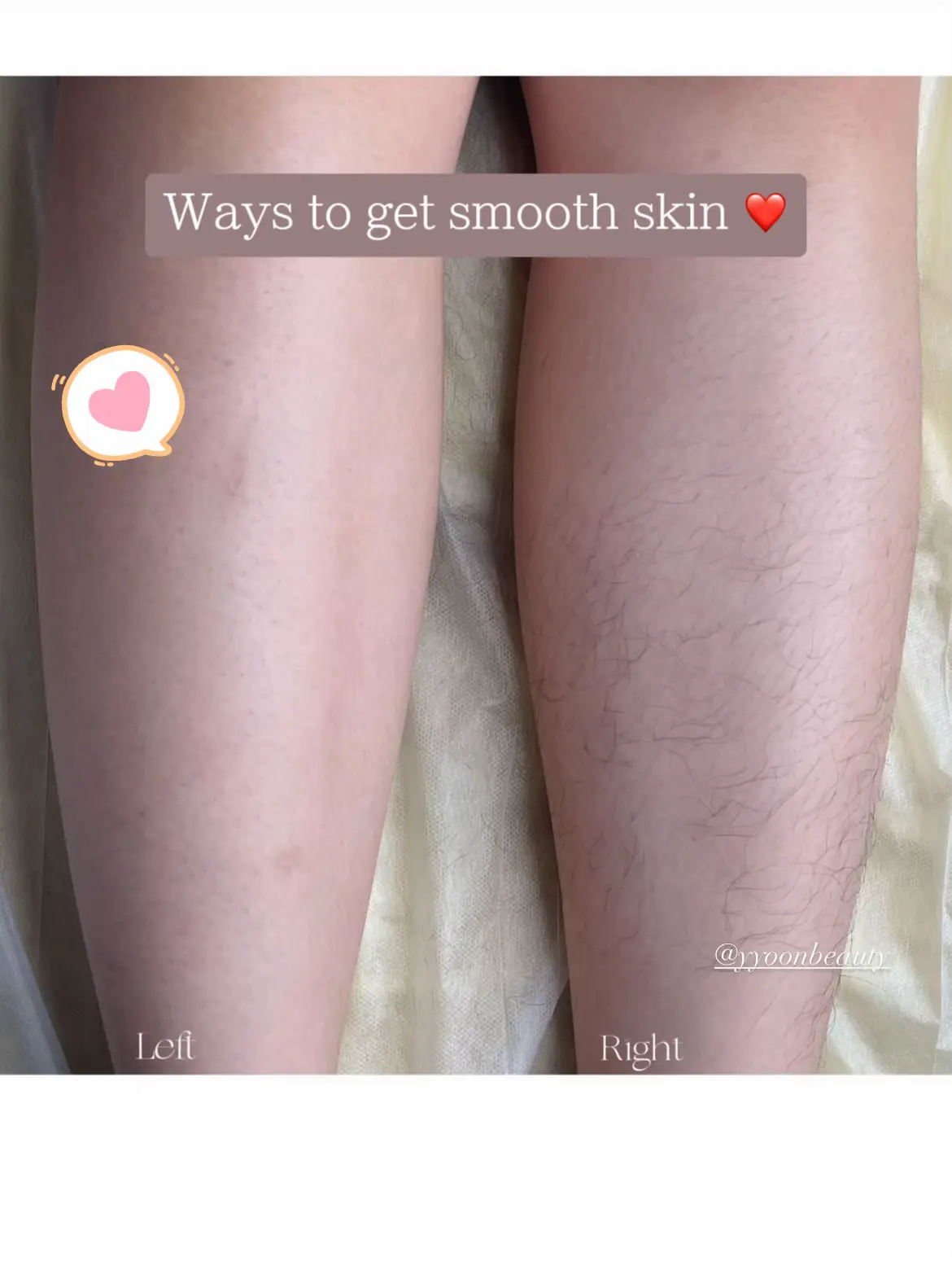 Smooth and Silky: Embrace the Beauty of Hair-Free | Galeri disiarkan oleh yyoonbeauty | Lemon8