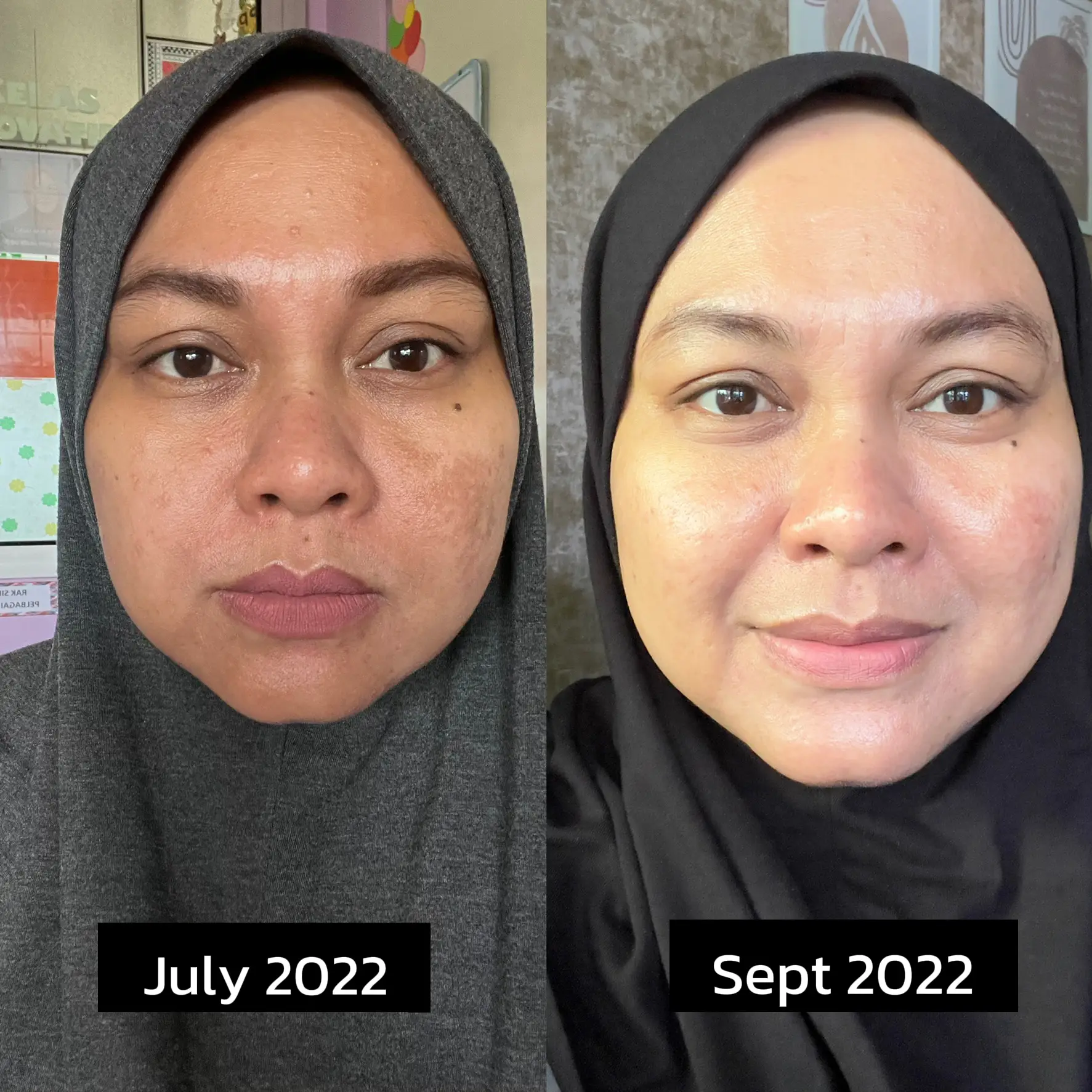 2 months journey | Galeri disiarkan oleh Nor Azwin Azlan | Lemon8