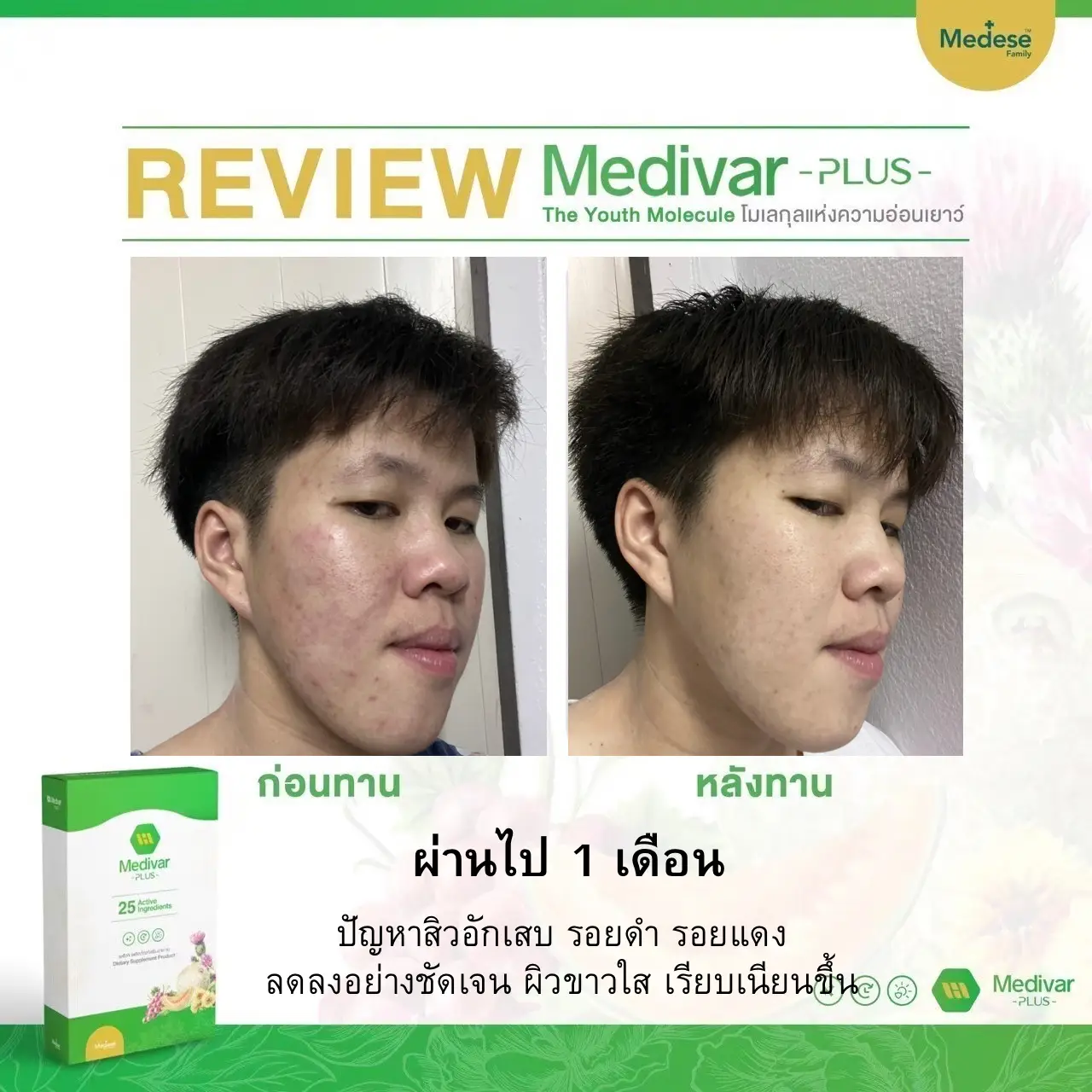 อาหารเสริมดูแลผิว(Medivar plus)💚 | แกลเลอรีที่โพสต์โดย MILK PARADISE | Lemon8