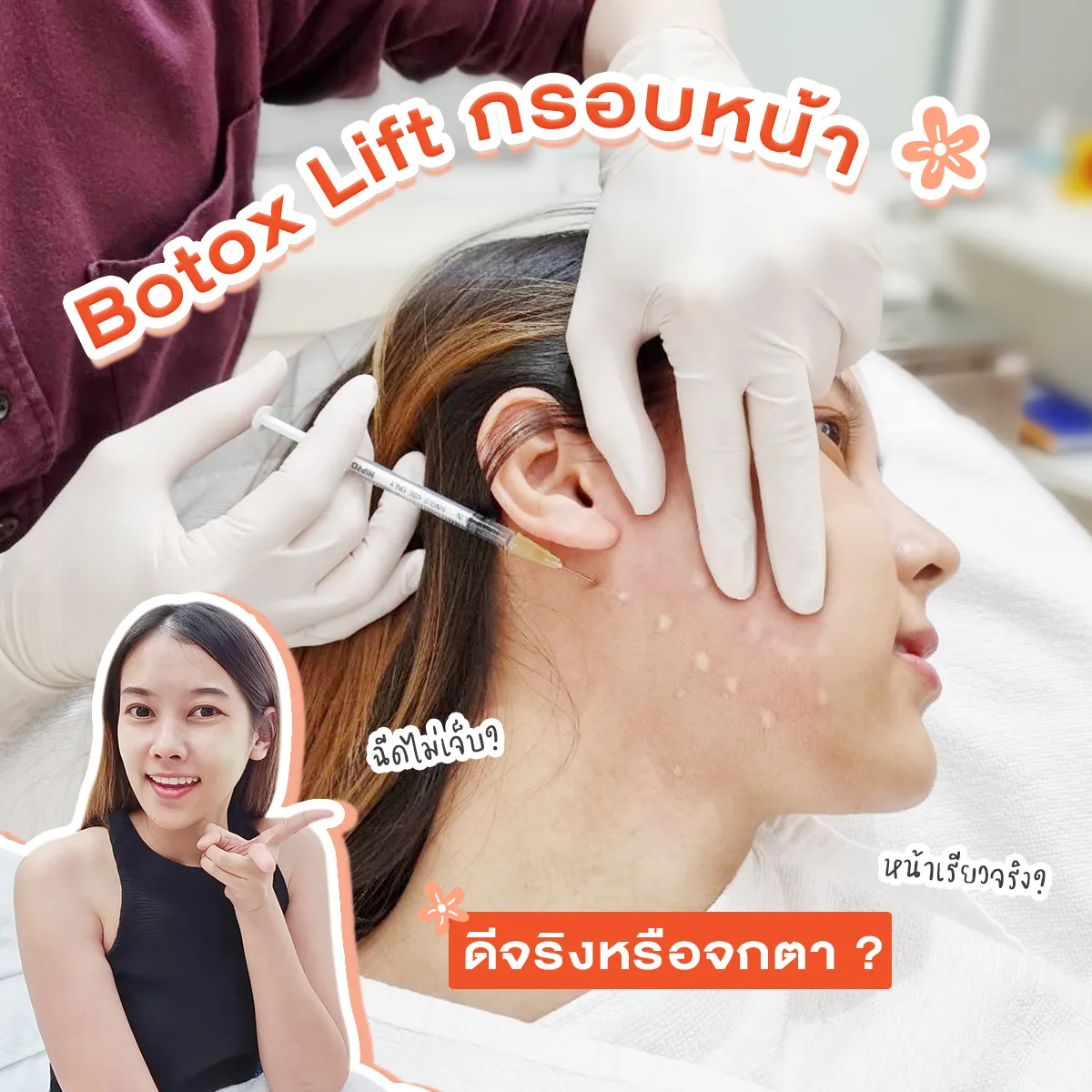 Botox lift กรอบหน้า ครั้งแรก ️ | แกลเลอรีที่โพสต์โดย aynuzii | Lemon8