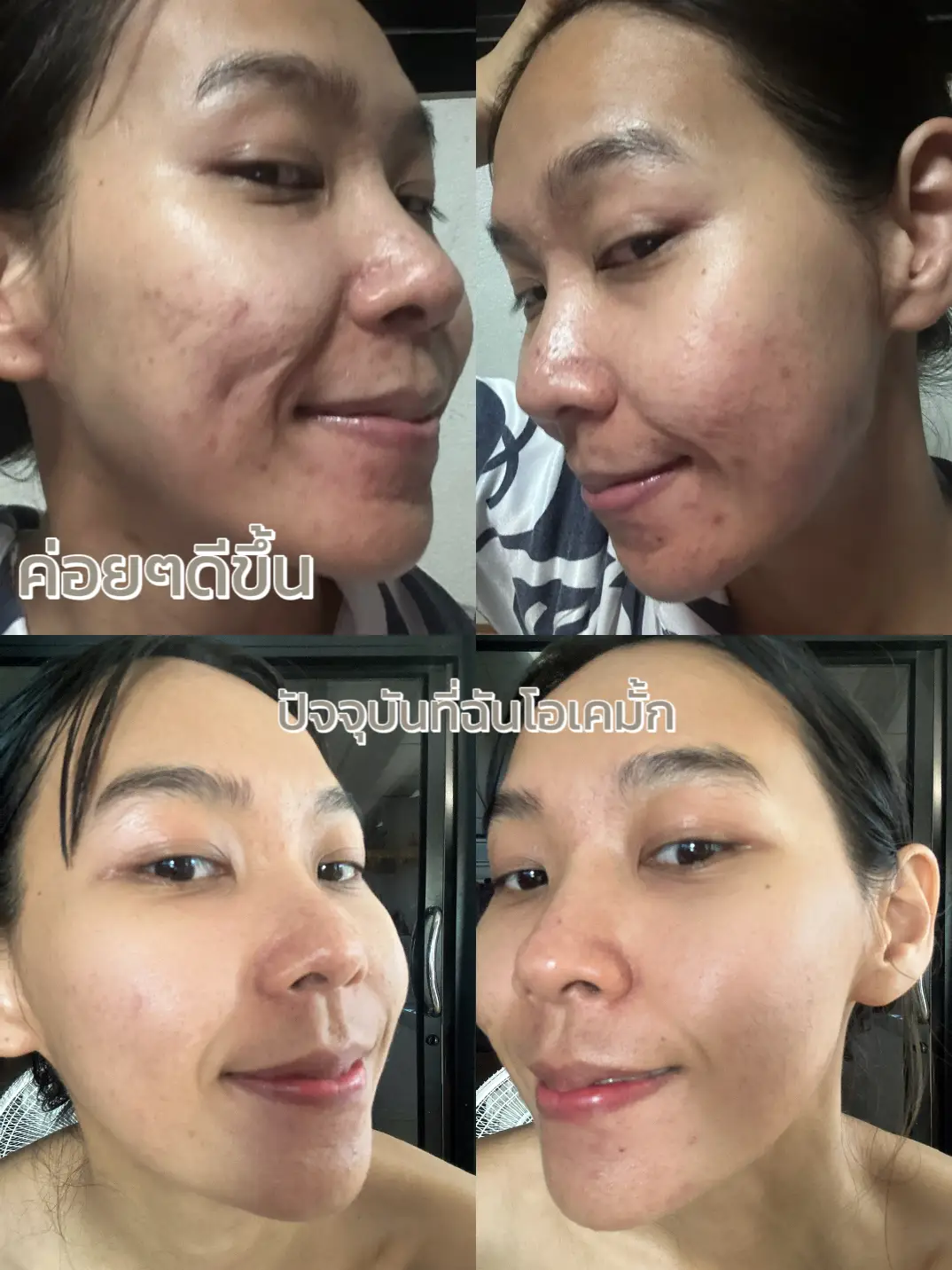 รีวิวบิ้วตี้สำหรับสาวขี้แพ้มาเกือบ20ปีตอนนี้ชนะแล้ว | แกลเลอรีที่โพสต์โดย patcharaporn Sa | Lemon8