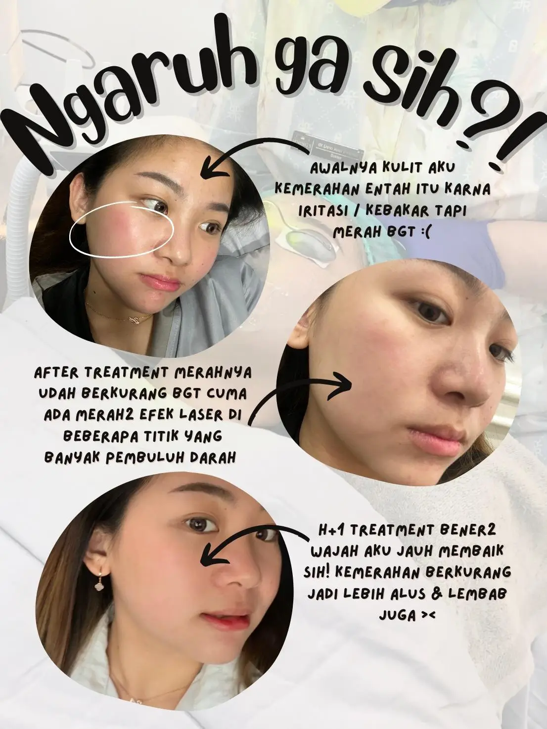 TREATMENT LASER PRO YELLOW 3JT-AN?!! WORTH IT?! | Galeri diposting oleh ...