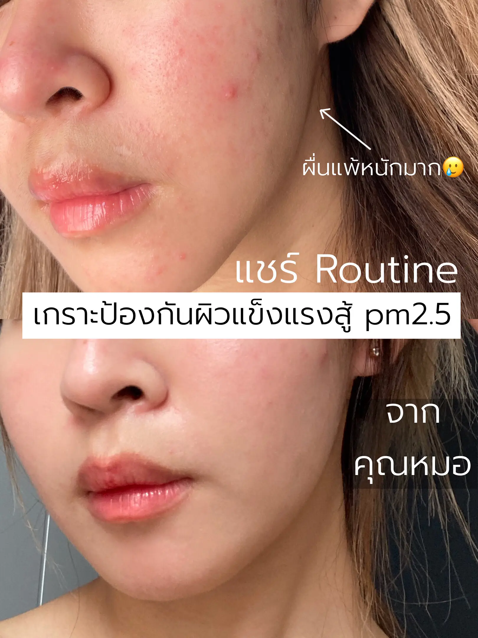 แชร์ Routine เกราะป้องกันผิวแข็งแรงสู้ pm2.5 ‼️ | แกลเลอรีที่โพสต์โดย Beautysweeties | Lemon8