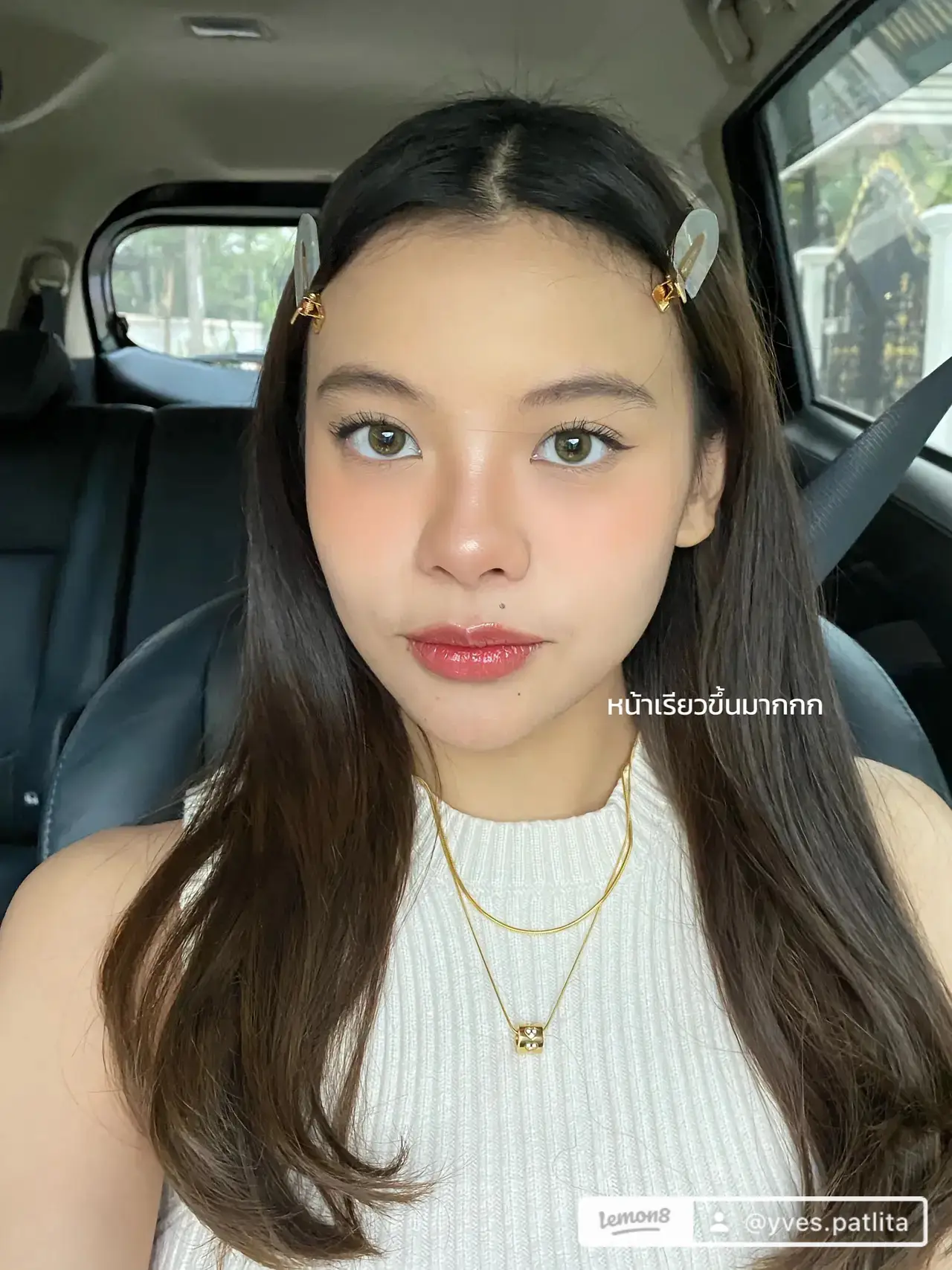 รีวิวหน้าเล็กกระชับไม่พึ่งเข็มด้วย Hifu ที่ muse clinic | แกลเลอรีที่โพสต์โดย Yves | Lemon8