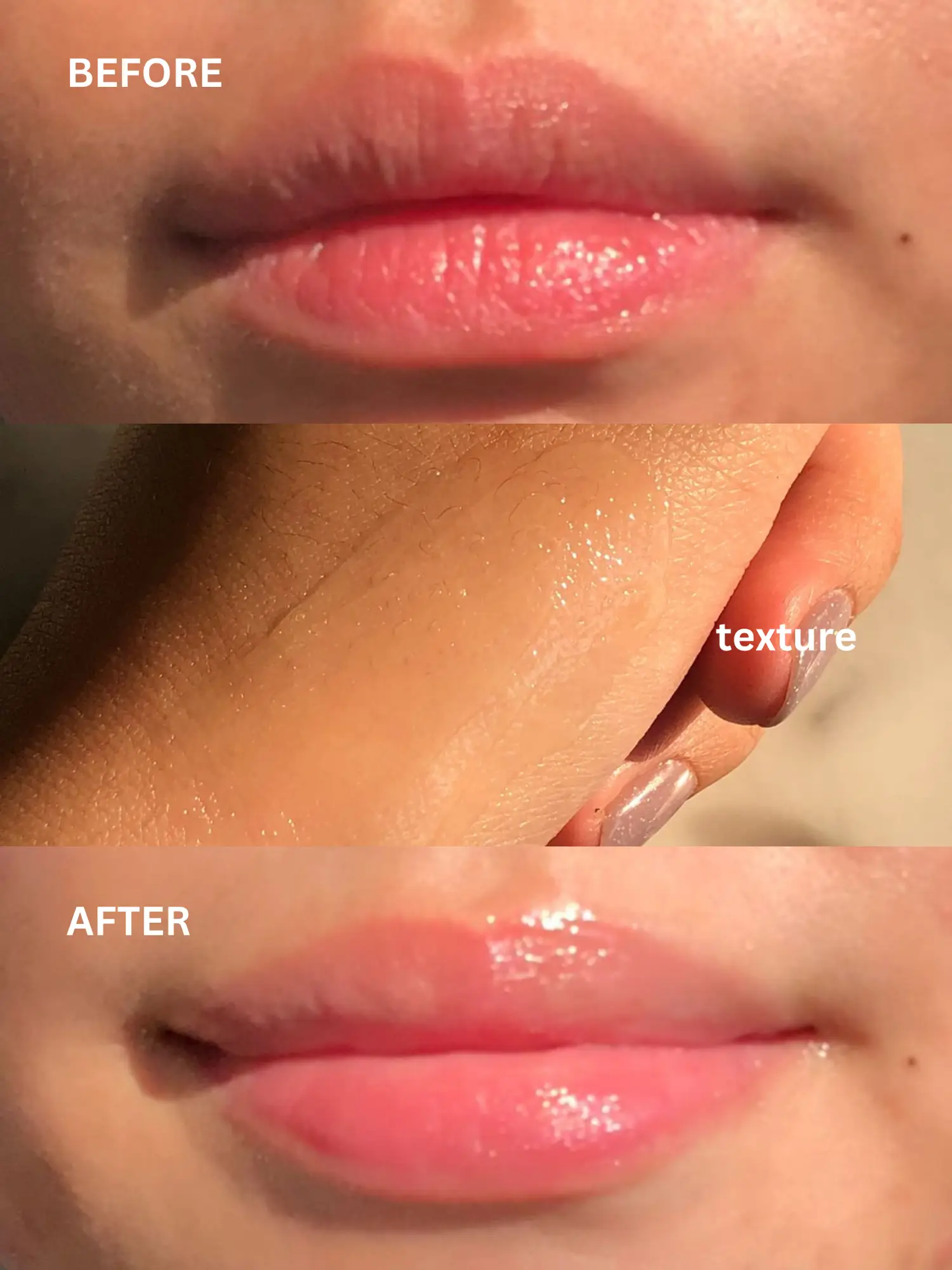 FIX YOUR LIPS NOW 👄 | Galeri diposting oleh mojojovita | Lemon8