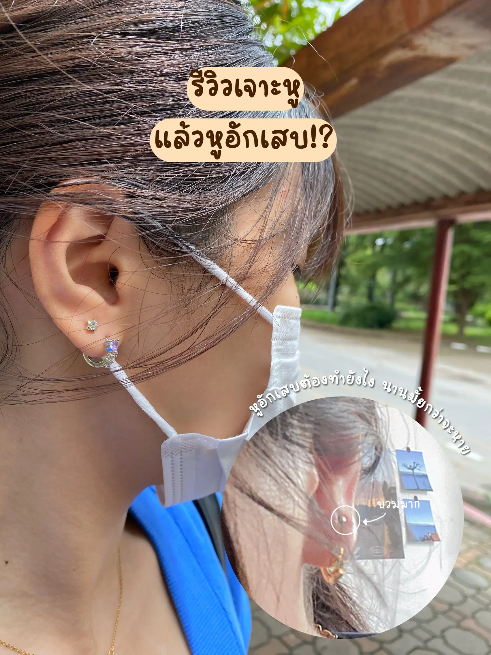 Ear piercing has not completed a month. Ear inflammation! | Gallery ...