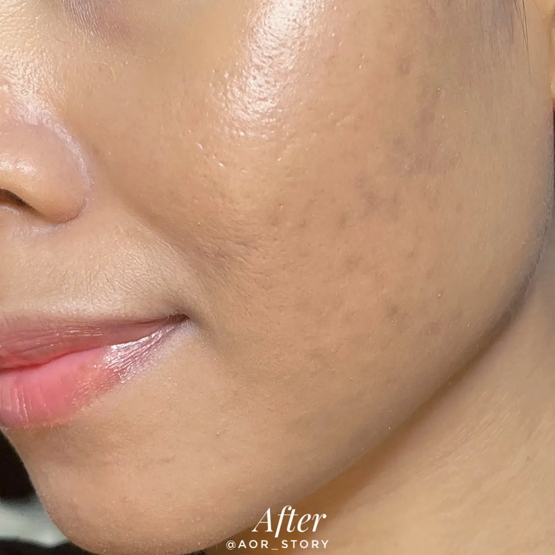 มันยังไงนะ | แกลเลอรีที่โพสต์โดย aor_story | Lemon8