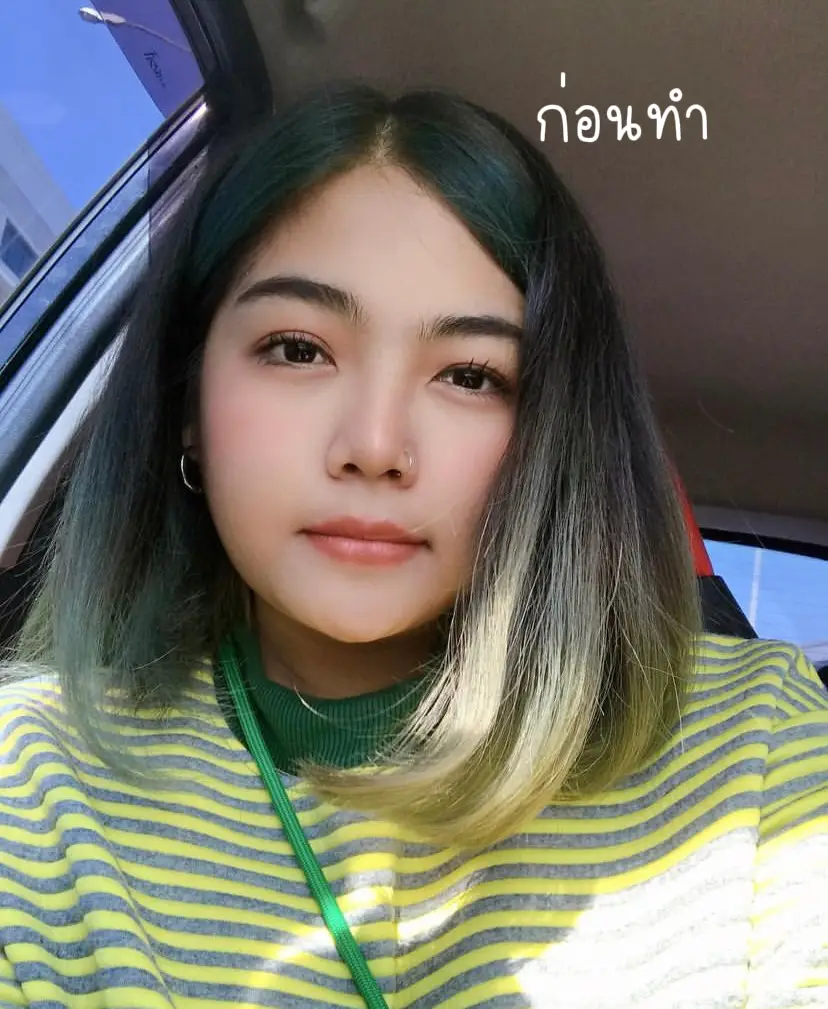 ประสบการณ์ทำคางแบบใช้ยานอนหลับ(แผลในปาก) | แกลเลอรีที่โพสต์โดย SPRAY🌻 | Lemon8