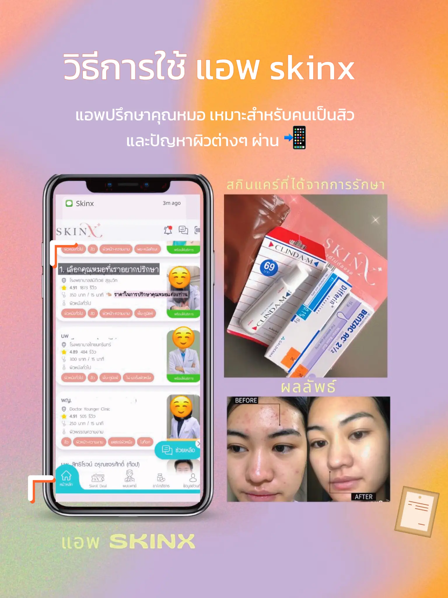 วิธีการใช้แอพ skinx ฉบับง่ายๆ รักษาสิวออนไลน์ | แกลเลอรีที่โพสต์โดย Ferngloryy | Lemon8