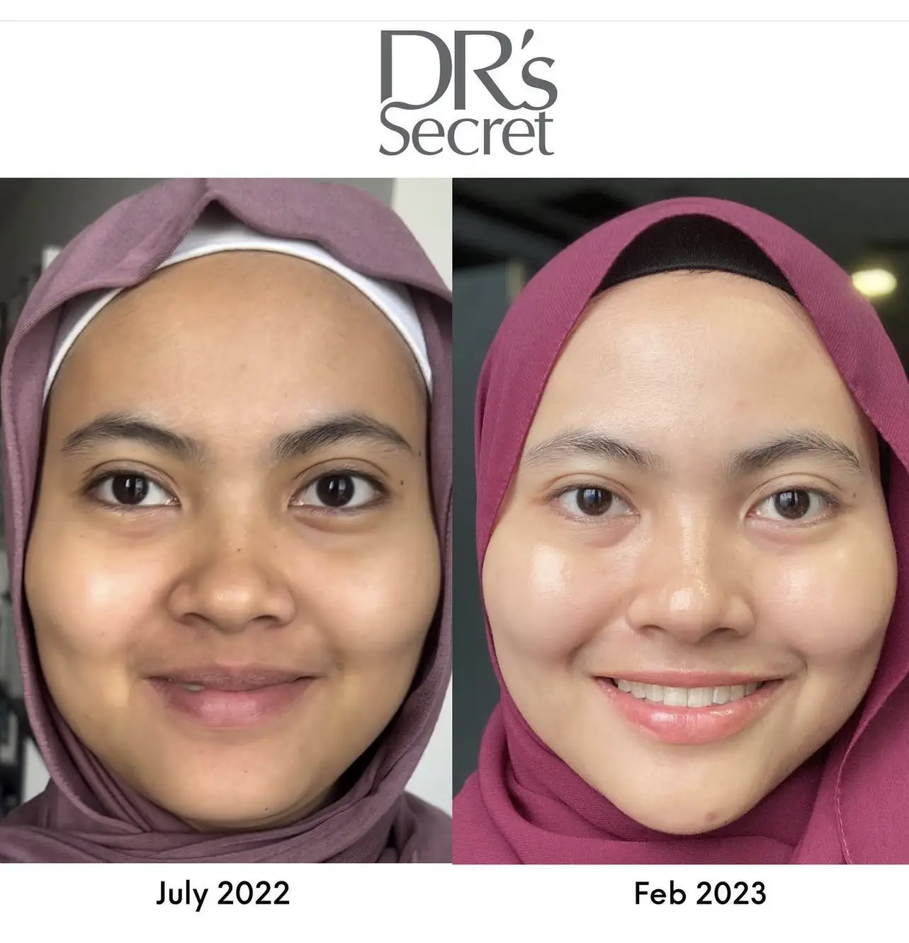 Dari KUSAM ke KULIT YANG SIHAT | Galeri disiarkan oleh Nor Azwin Azlan ...