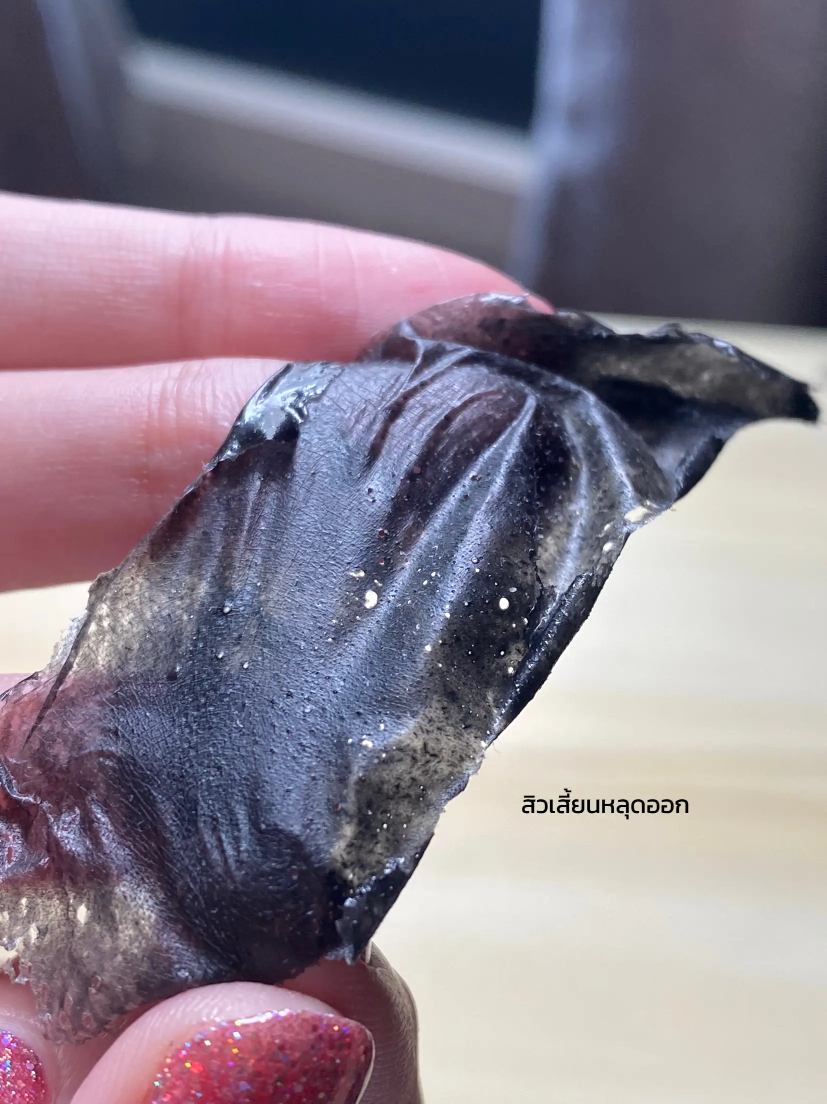 ที่ลอกสิวเสี้ยน | แกลเลอรีที่โพสต์โดย syn | Lemon8