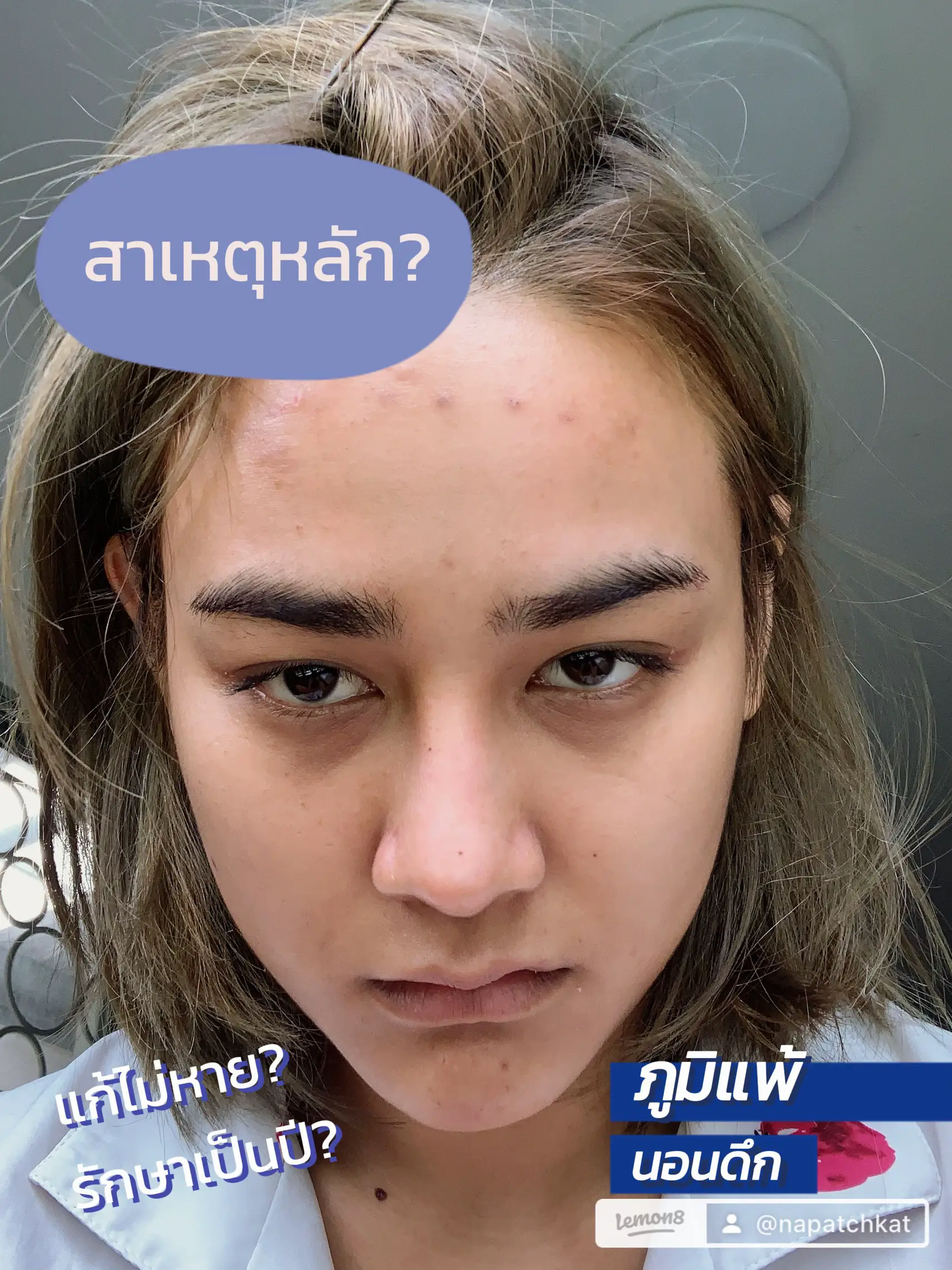 ขอบตาหายดำฉบับหมีแพนด้าสุดๆ | แกลเลอรีที่โพสต์โดย Napatch.kat | Lemon8