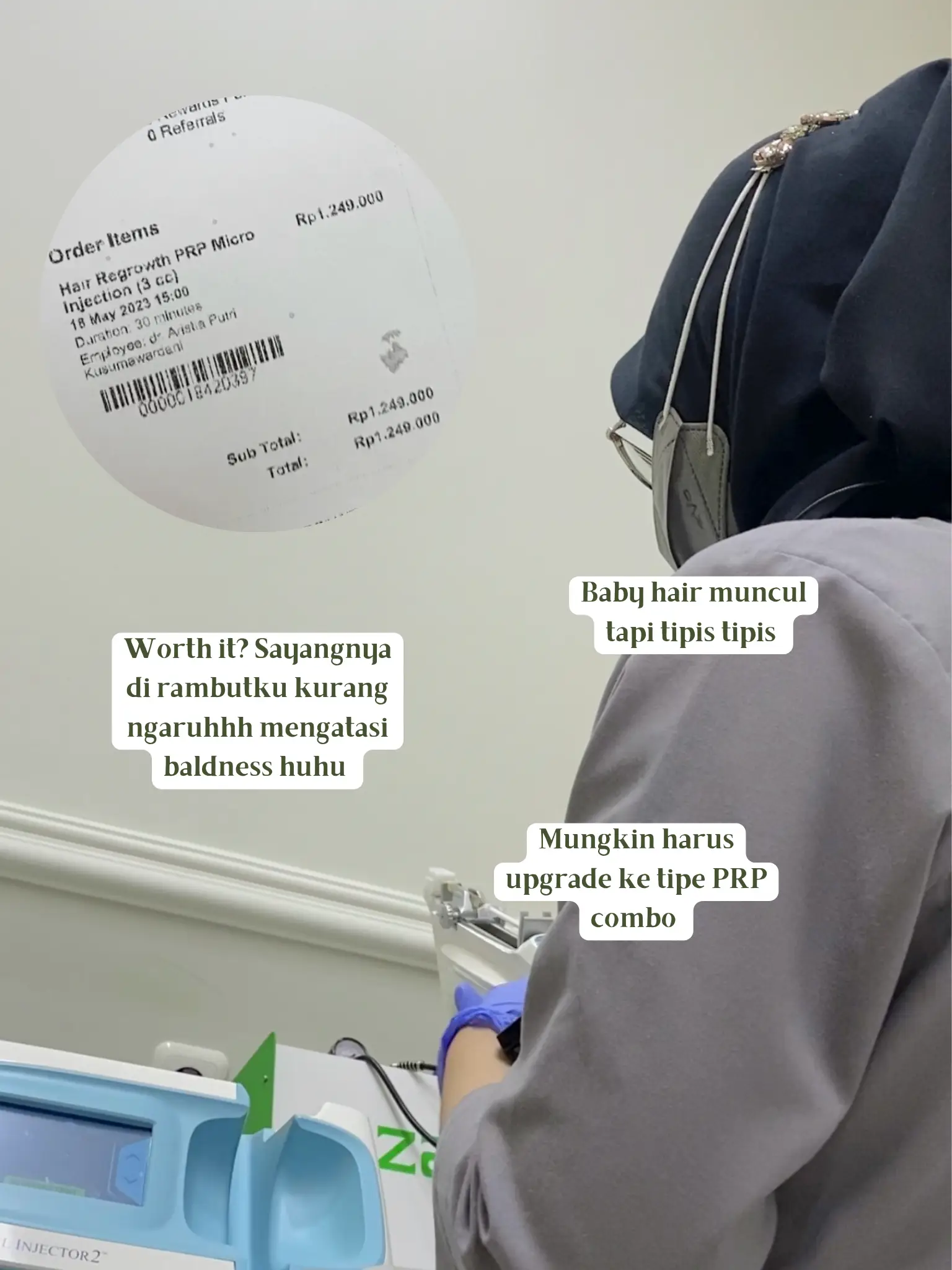 Treatment PRP untuk Rambut! Worth it gak sih? | Galeri diposting oleh ...