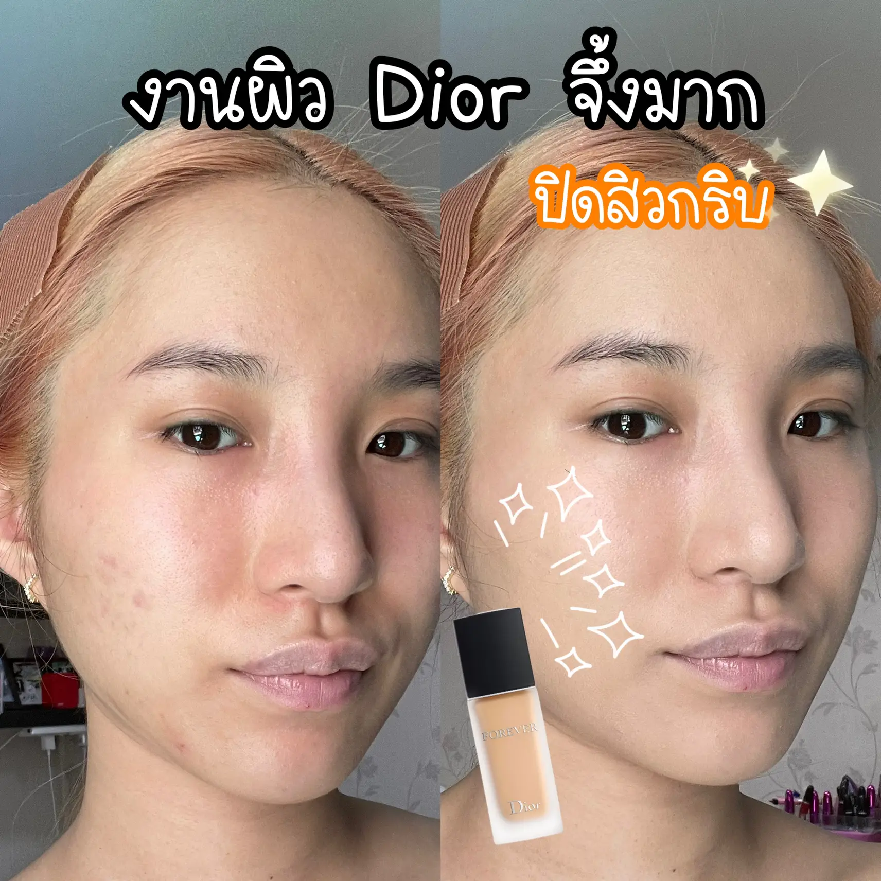 เปลี่ยนหน้าสิวเป็นผิวสวยด้วย Dior Forever 24H Foundation | แกลเลอรีที่โพสต์โดย Lookseesom | Lemon8