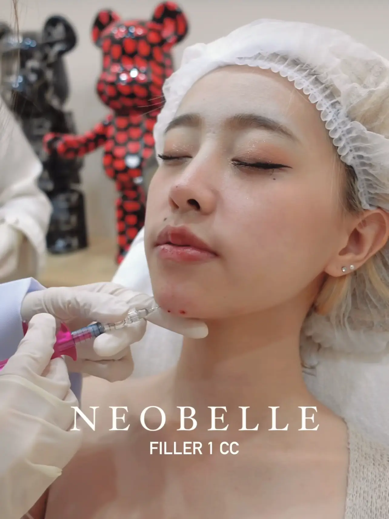Filler คาง 1cc เท่านั้นปังมากกกกแก‼️‼️ | แกลเลอรีที่โพสต์โดย MBC.CLINIC | Lemon8