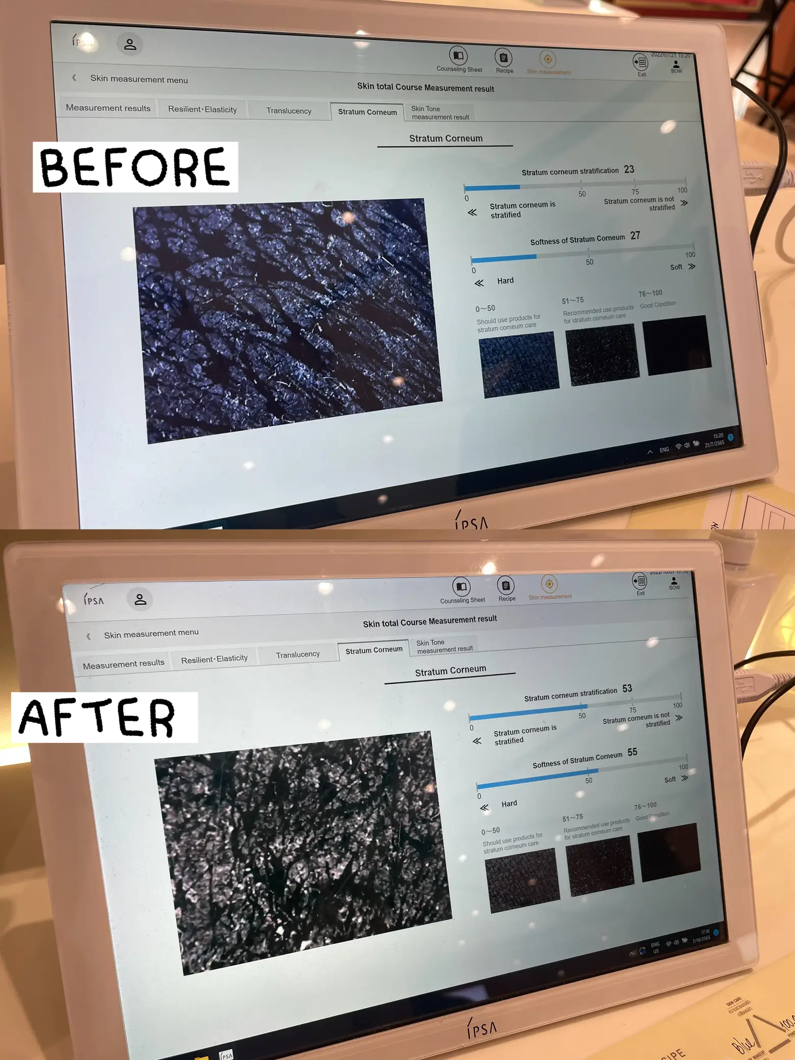 มาตรวจผิวรอบ 2 ที่ IPSA หลังใช้ผลิตภัณฑ์มา 2 เดือน🤍 | แกลเลอรีที่โพสต์โดย cinearism💀 | Lemon8