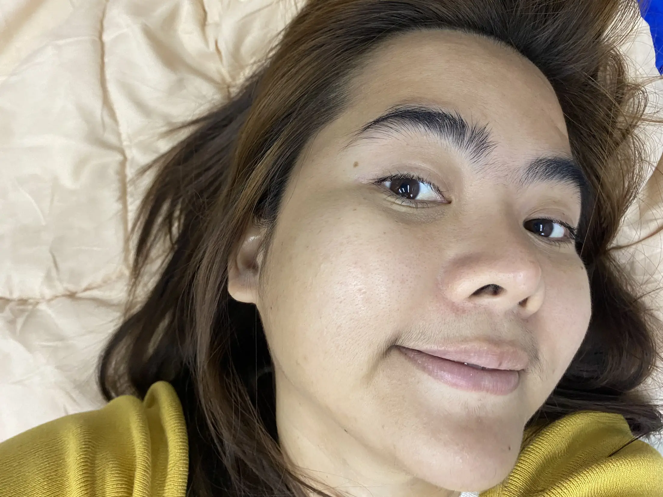 หน้าสิว และ ลิฟติ้งขนตา | แกลเลอรีที่โพสต์โดย Nannii | Lemon8