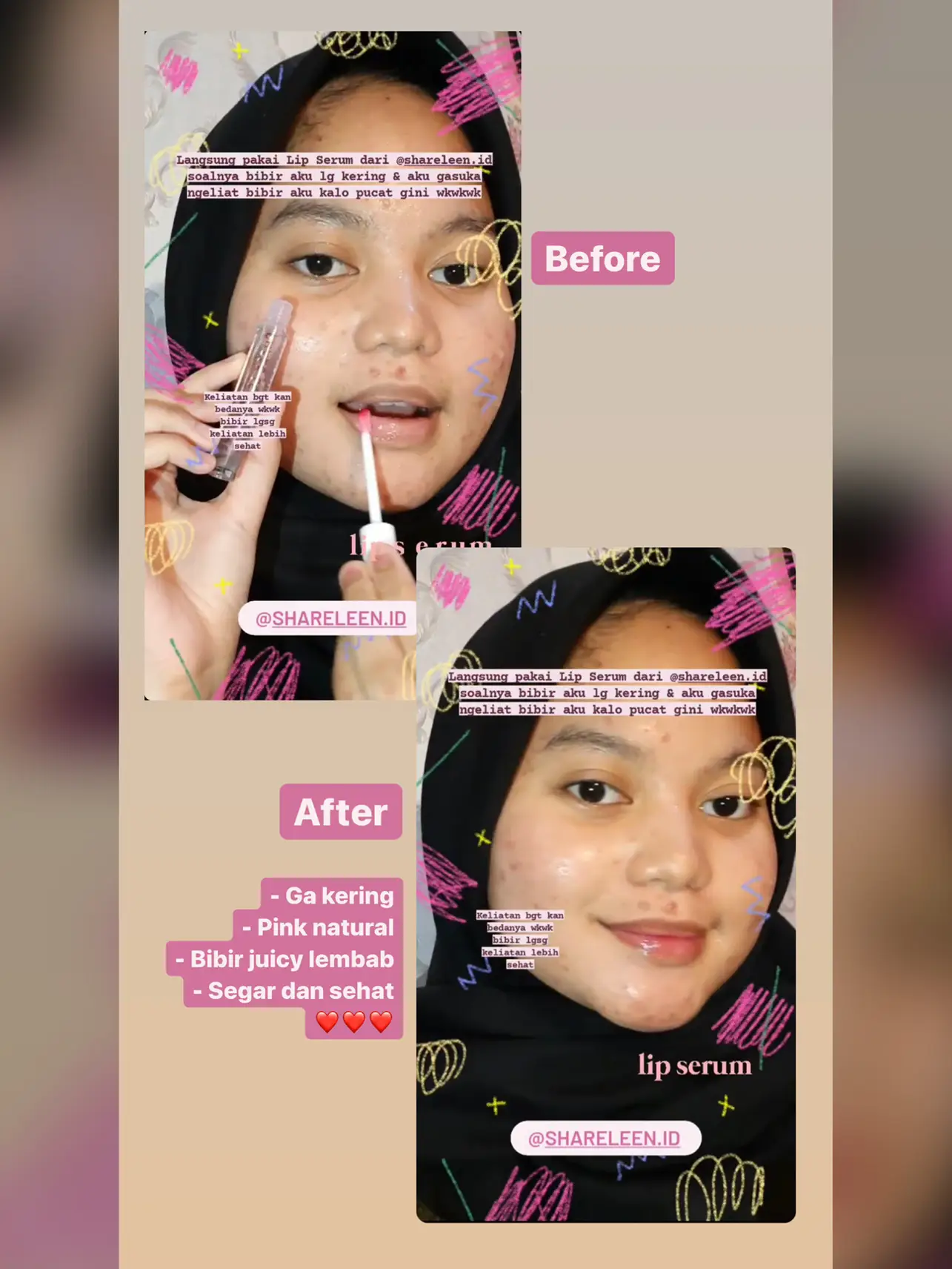 Before After Lip Serum | Video dipublikasikan oleh ShareLeenBeauty | Lemon8