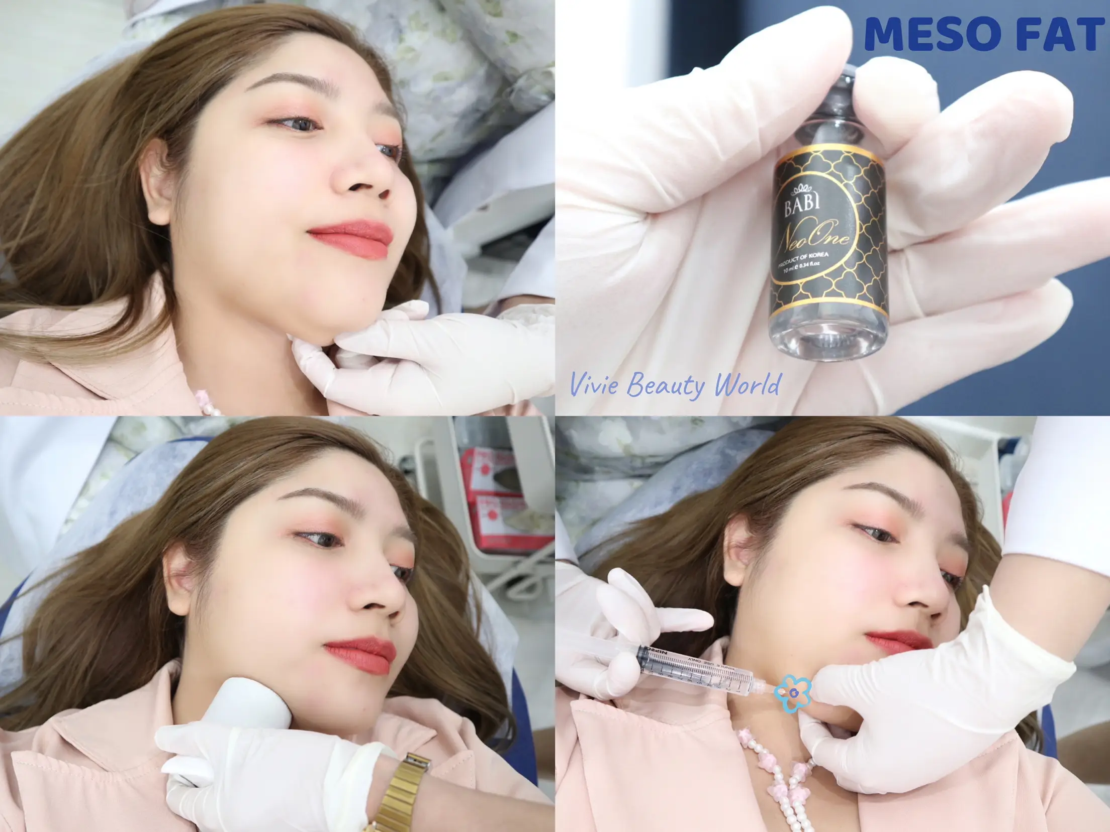 หน้าเล็ก เหนียงลด Ultraformer III& Meso Fat @Raparis | แกลเลอรีที่โพสต์โดย Vivie_World | Lemon8