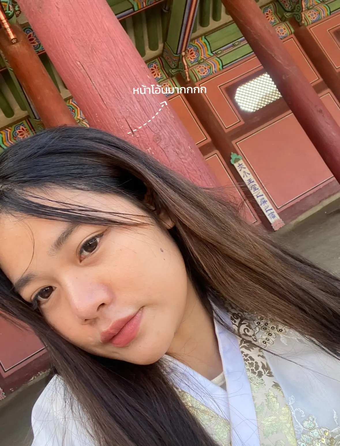 📍ฉีดโบท็อกกราม ริ้วรอย งบ 5 Xxx บาท แกลเลอรีที่โพสต์โดย Noina🩷 Lemon8
