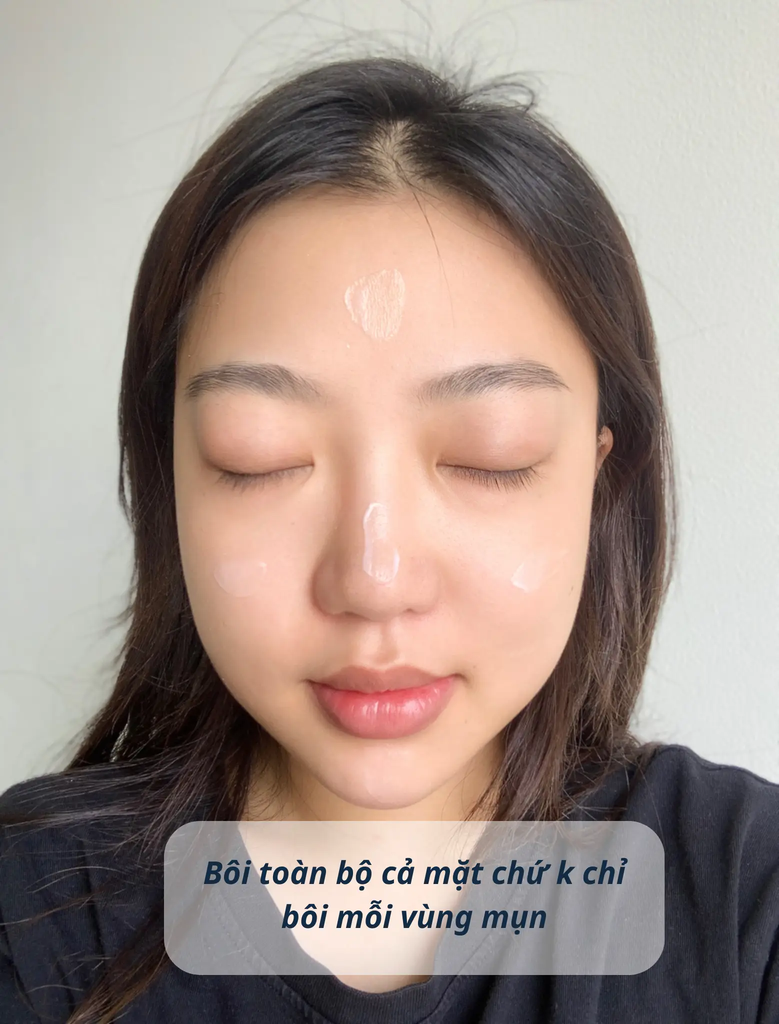 Những lưu ý khi sử dụng differine trị mụn 🗒️ | Bộ sưu tập do Hà Vy Xinh đăng | Lemon8
