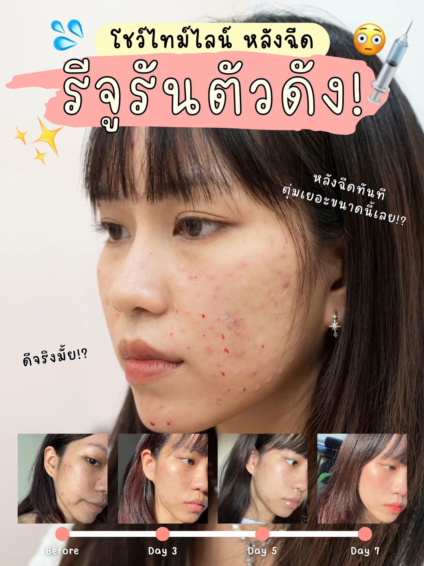 20 ไอเดียยอดนิยมเกี่ยวกับ ครีมรีจูรัน ดีไหม Pantip ในปี 2024