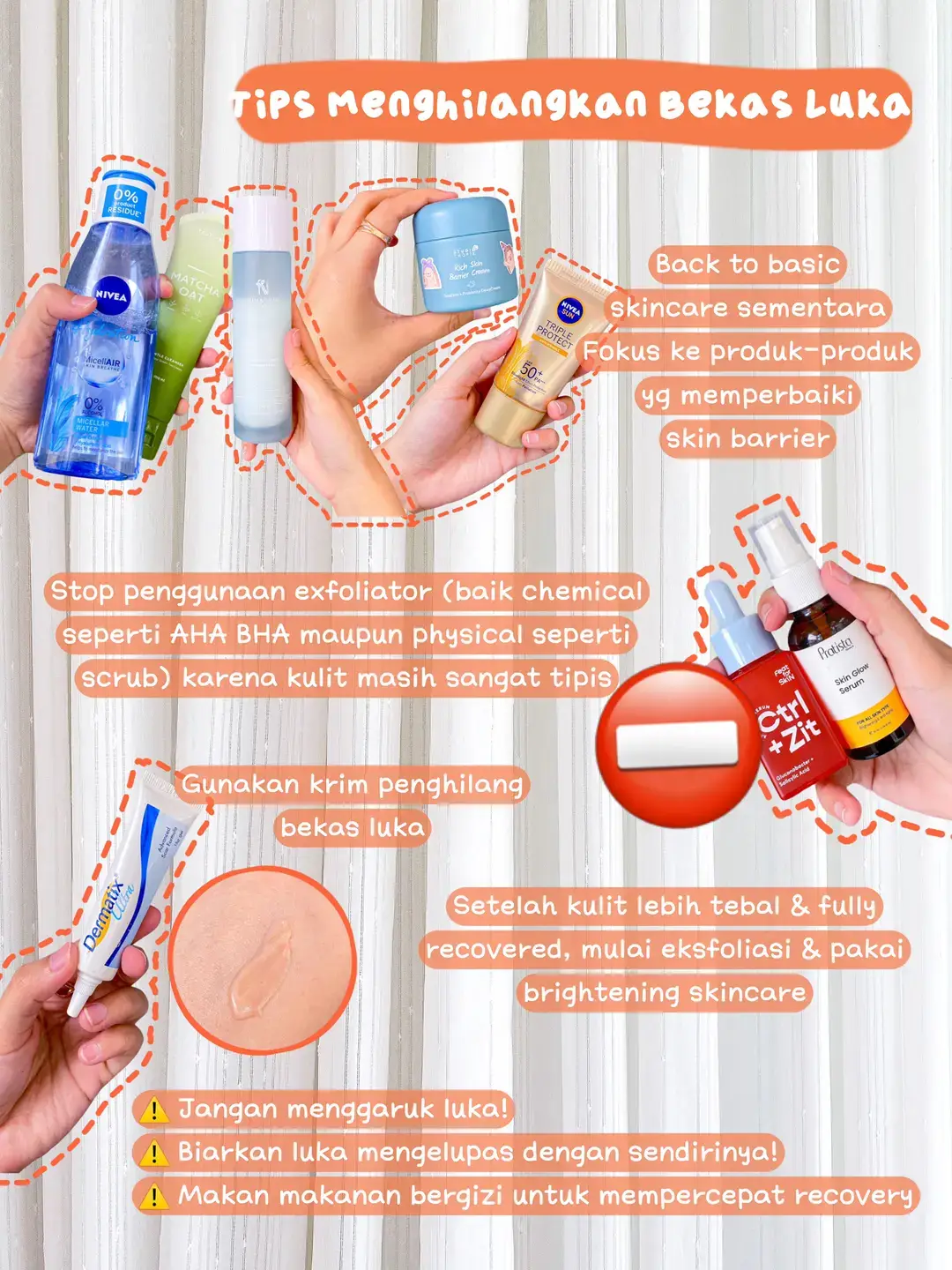 CARA AKU SEMBUH DARI LUKA KECELAKAAN DENGAN CEPAT! | Galeri diposting ...