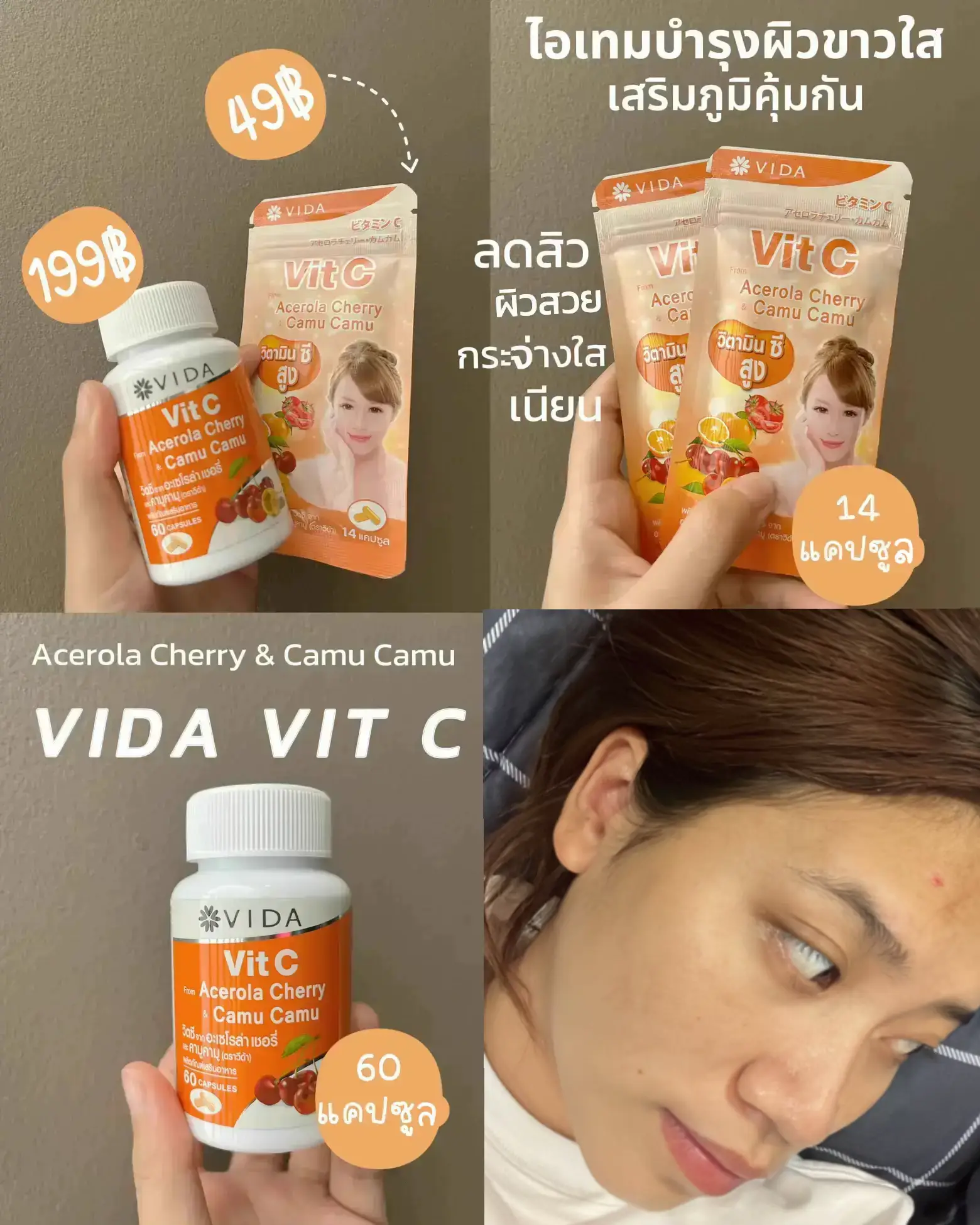 ร่างกายต้องการ vitamin c ต่อวันเท่าไร | 2024 ประสบการณ์ผู้ใช้จริงบน Lemon8
