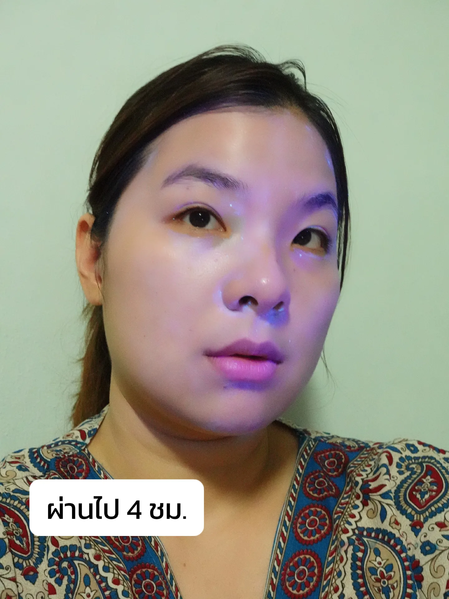 เช็คด้วย กล้อง UV !! ทากันแดด พอมั้ย? น้อยไป? | แกลเลอรีที่โพสต์โดย aomy | Lemon8