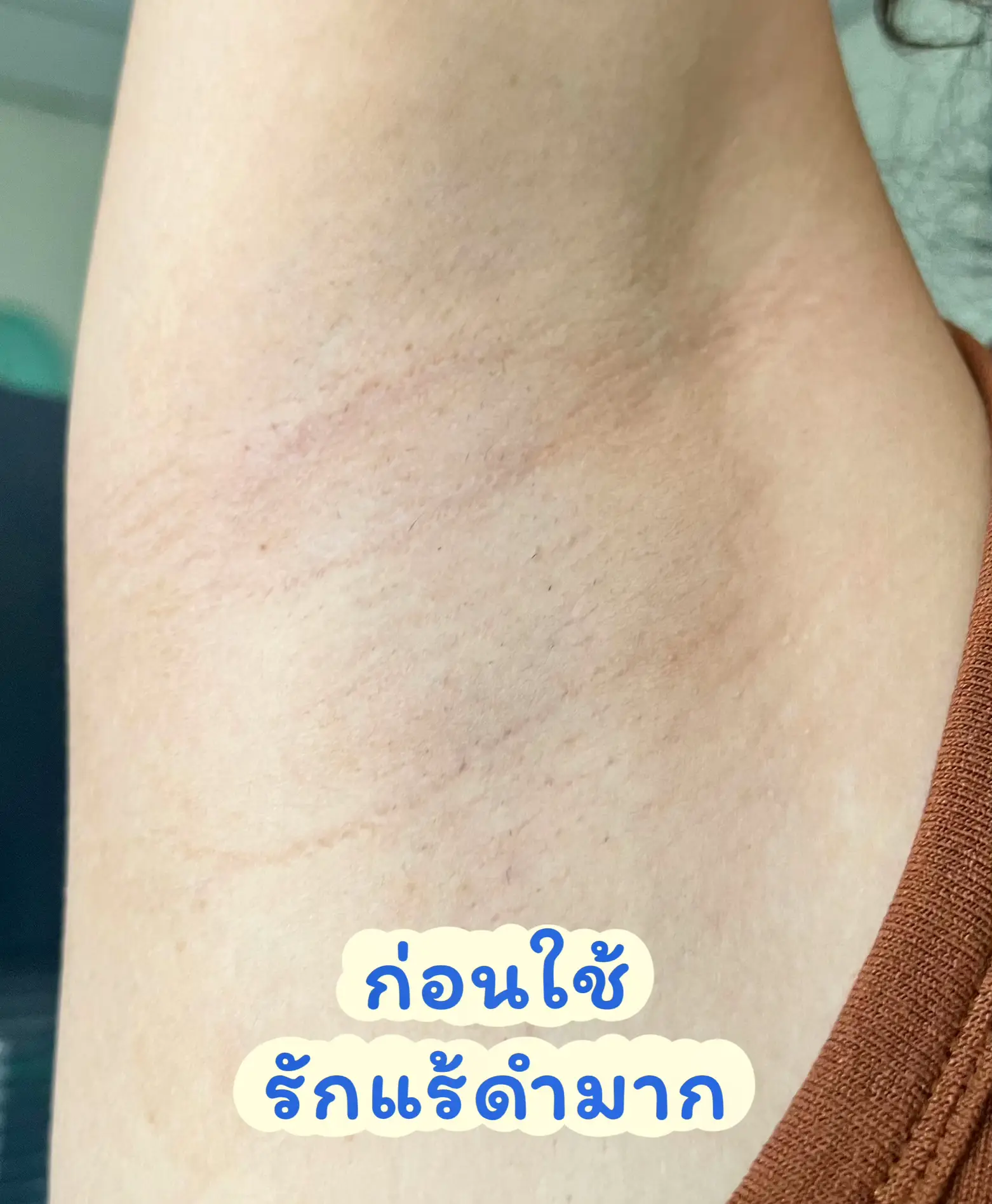Tell me the secret trick that makes the armpit white and smooth in 10 ...