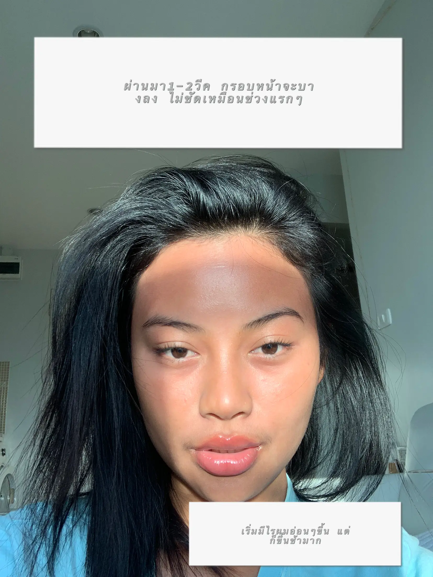 รีวิวการแว๊กไรผมสุดโหด | แกลเลอรีที่โพสต์โดย Natcher | Lemon8